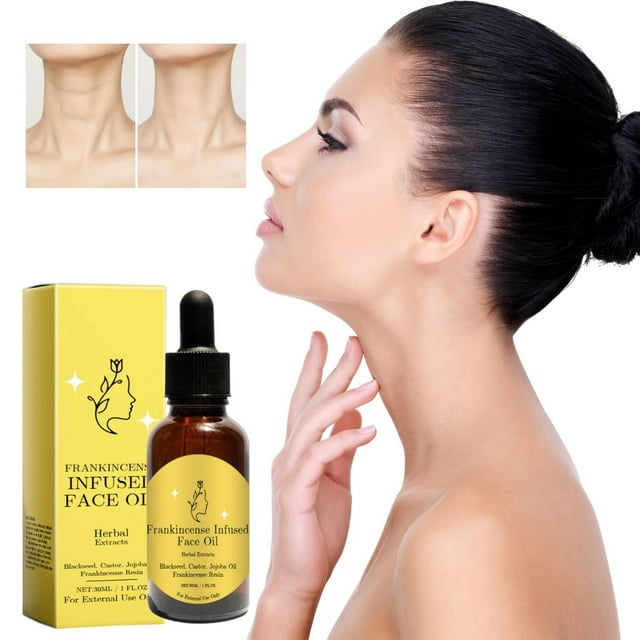 KPLFUBK Frankincense Resin Infused Black Seed Jojoba Oils For Facial Moisturizer Cold Pressed ...