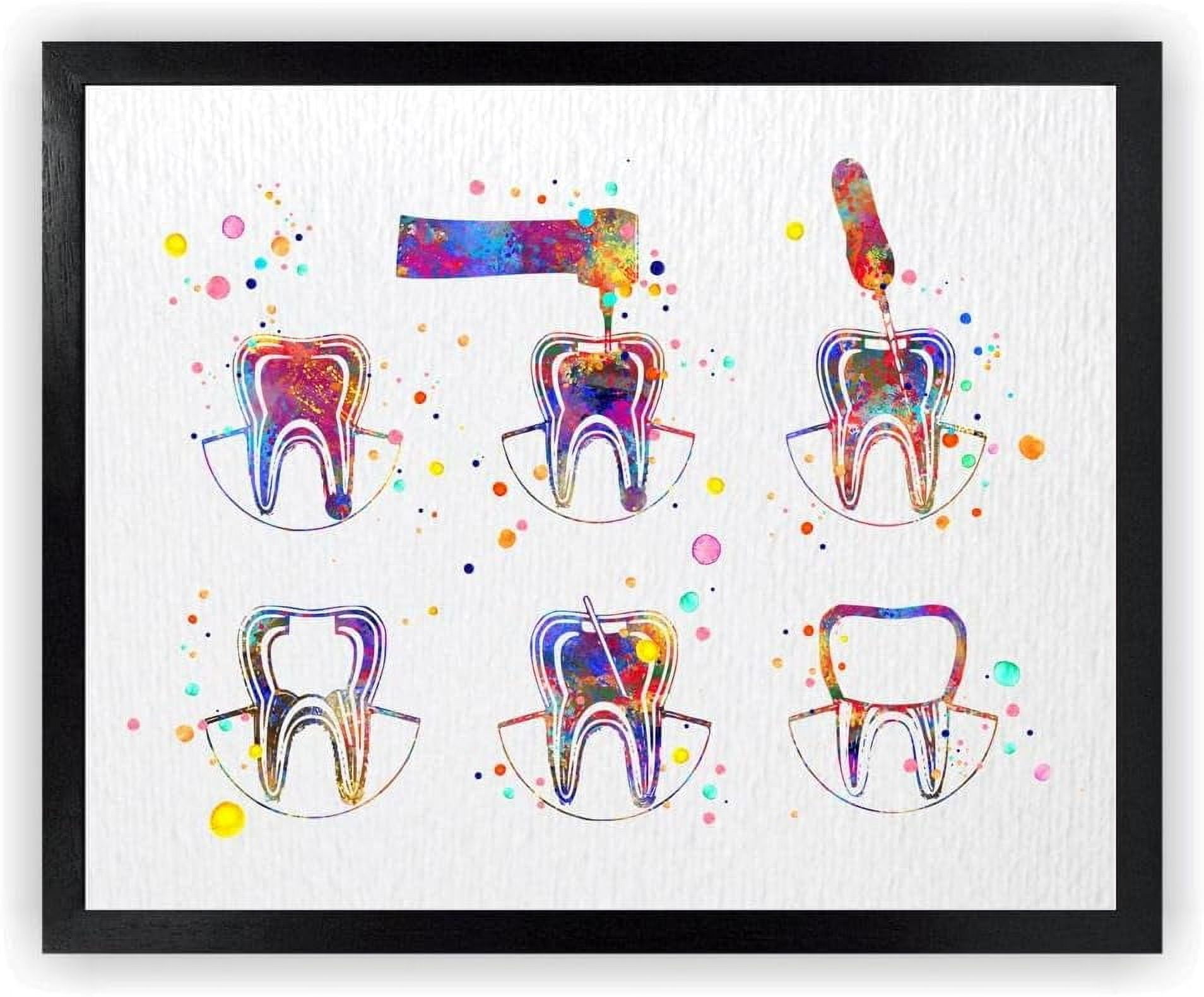 KSIW-11X14 Unframed Endodontics Therapy Treatment Tooth Watercolor Art ...