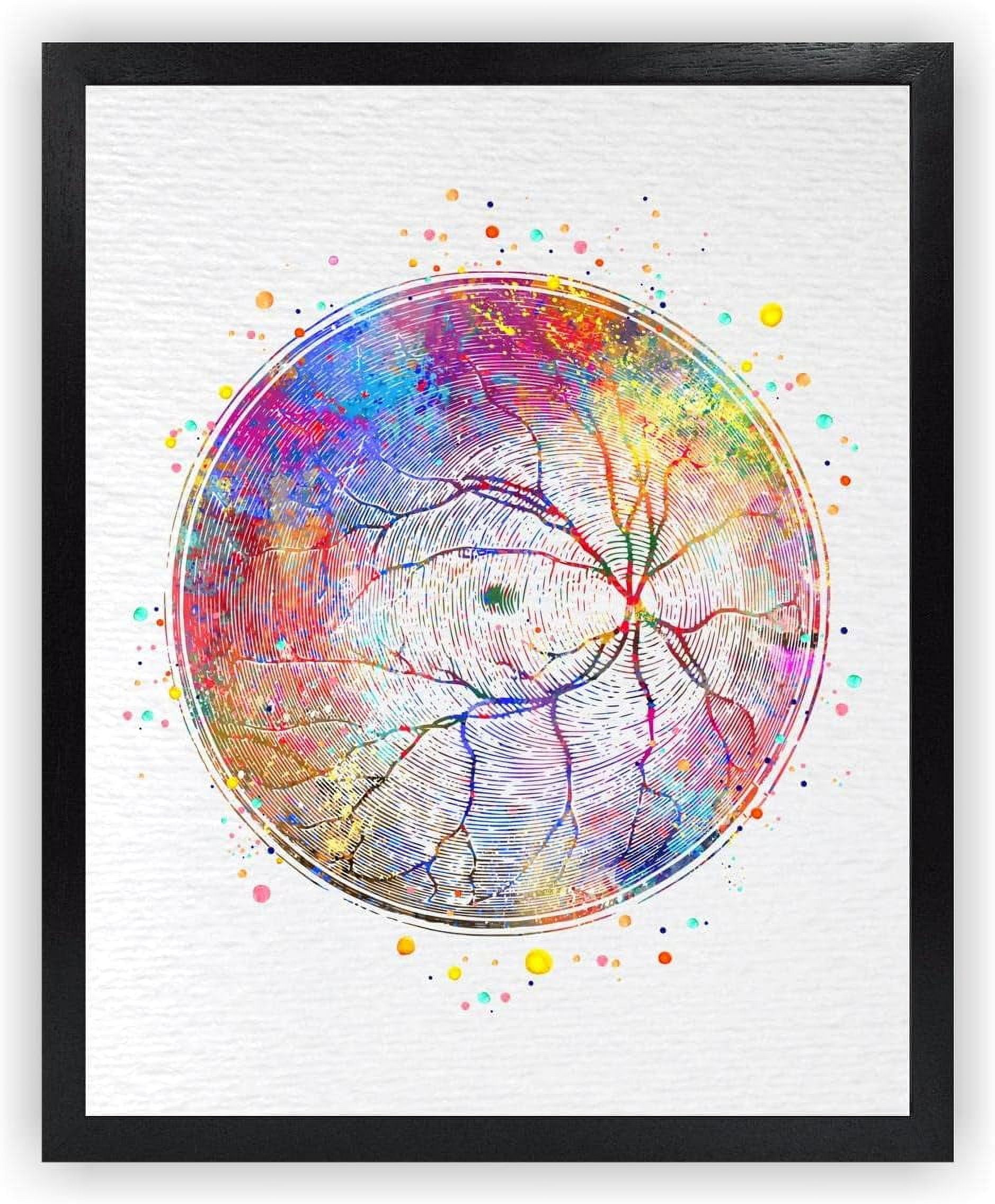 KSIW- 13X19 Unframed Retinal Vessels Artery Human Eye Anatomy ...