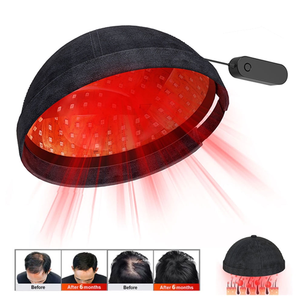 KTS Laser Cap Hair Growth System for Men & Women - Effective Thinning ...