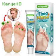 CALLUS TERMINATOR - Walmart.com