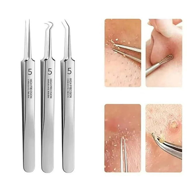 Kehuo Professional Pore Pimple Face Cleaner Kit, Stainless Steel Facial ...