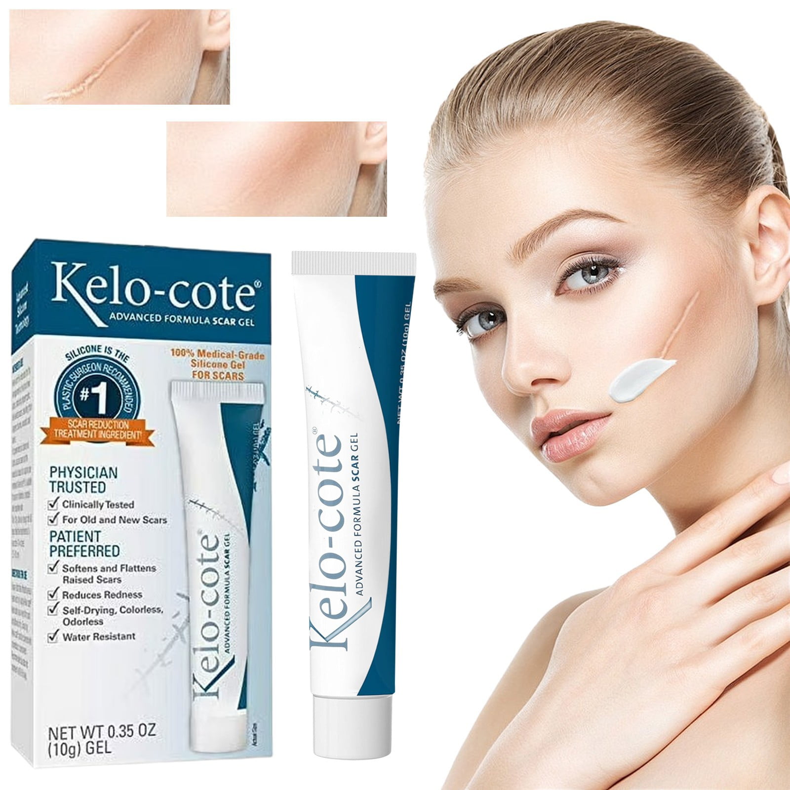 Kelo-Cote Advanced Silicone Scar Gel 10g – Medical Grade Scar Treatment ...