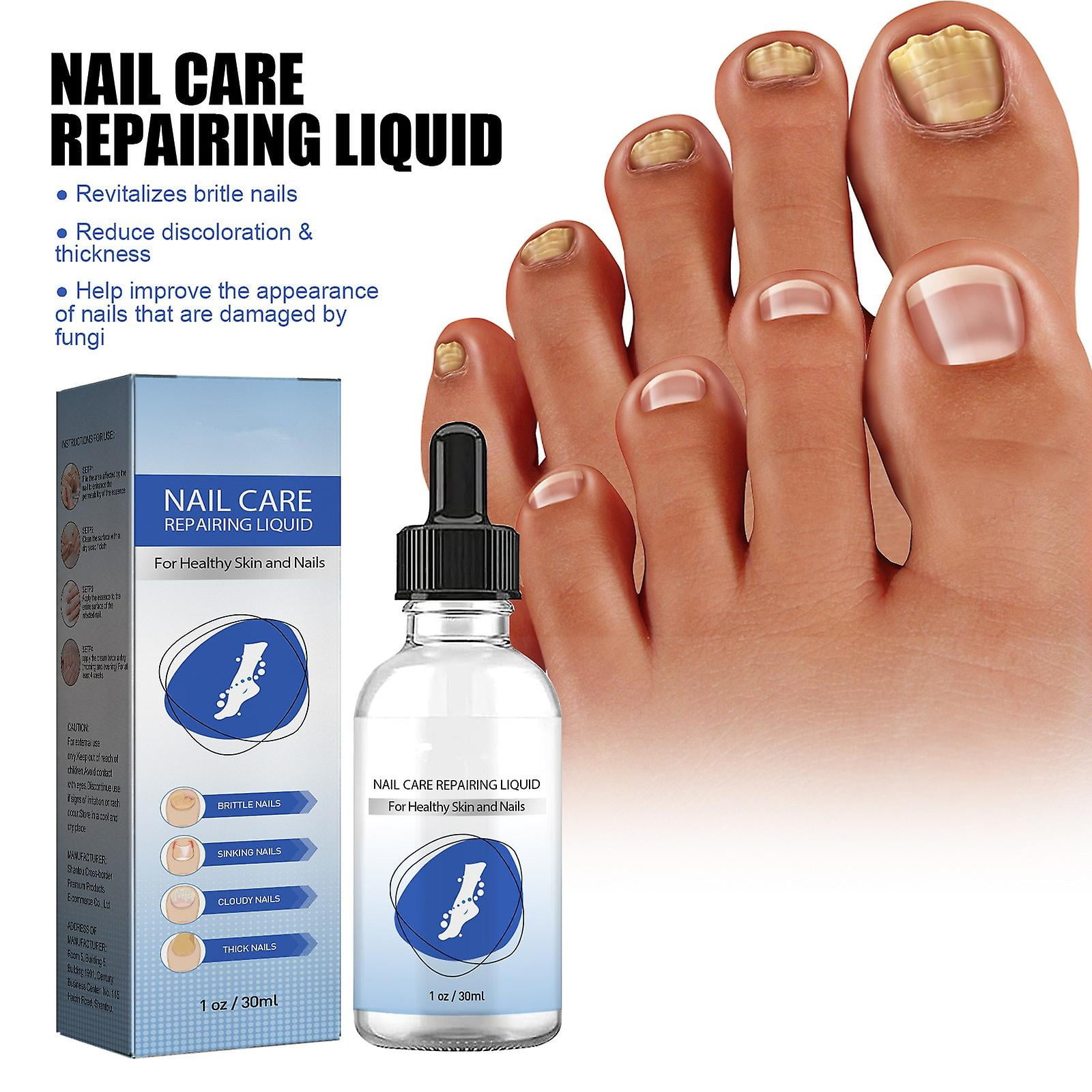 Kerassentials Toenail Treatment Oil, Toenail Treatment Extra Strength ...