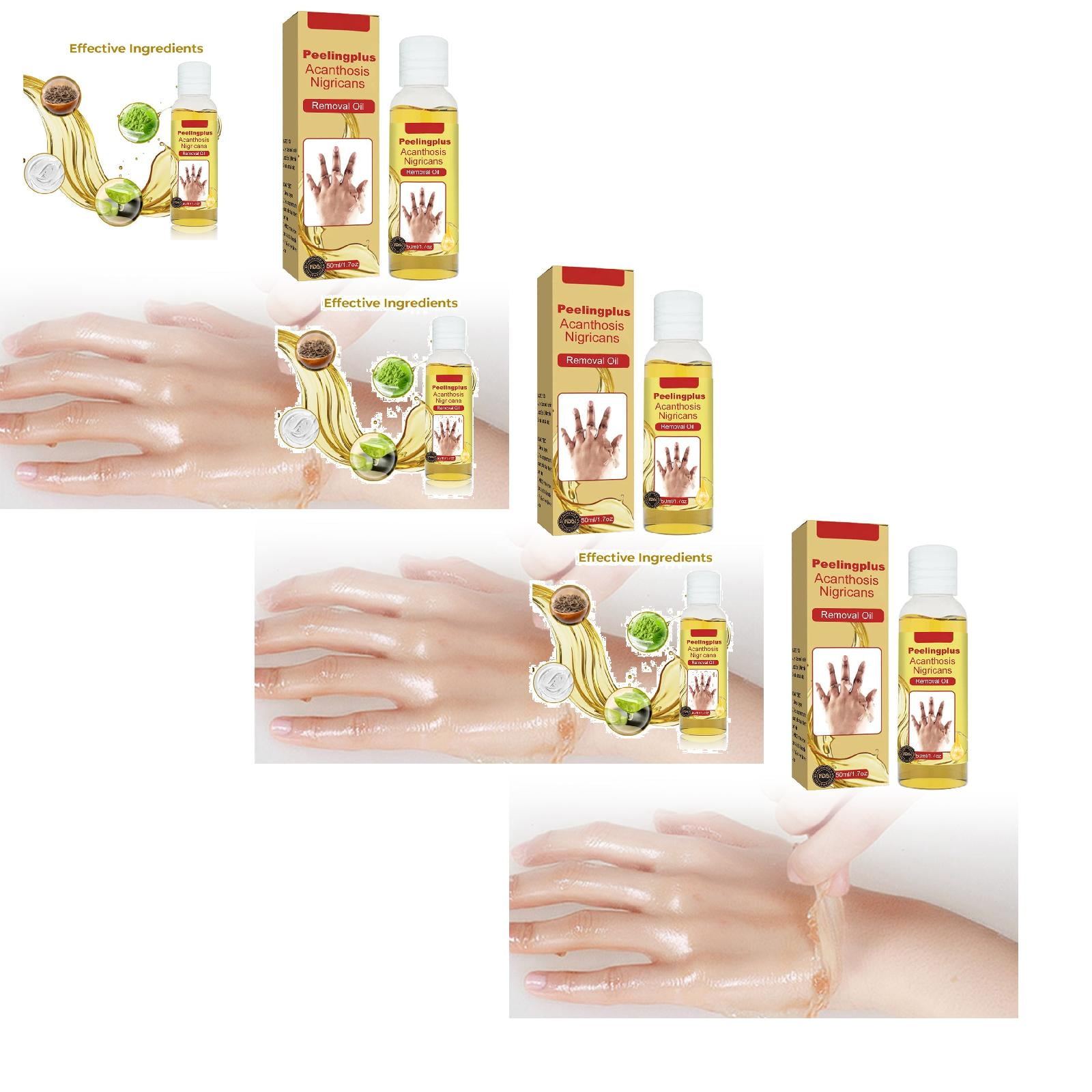 Keratosis Exfoliating Oil Underarms Knees Elbows Joints Brighten Skin ...