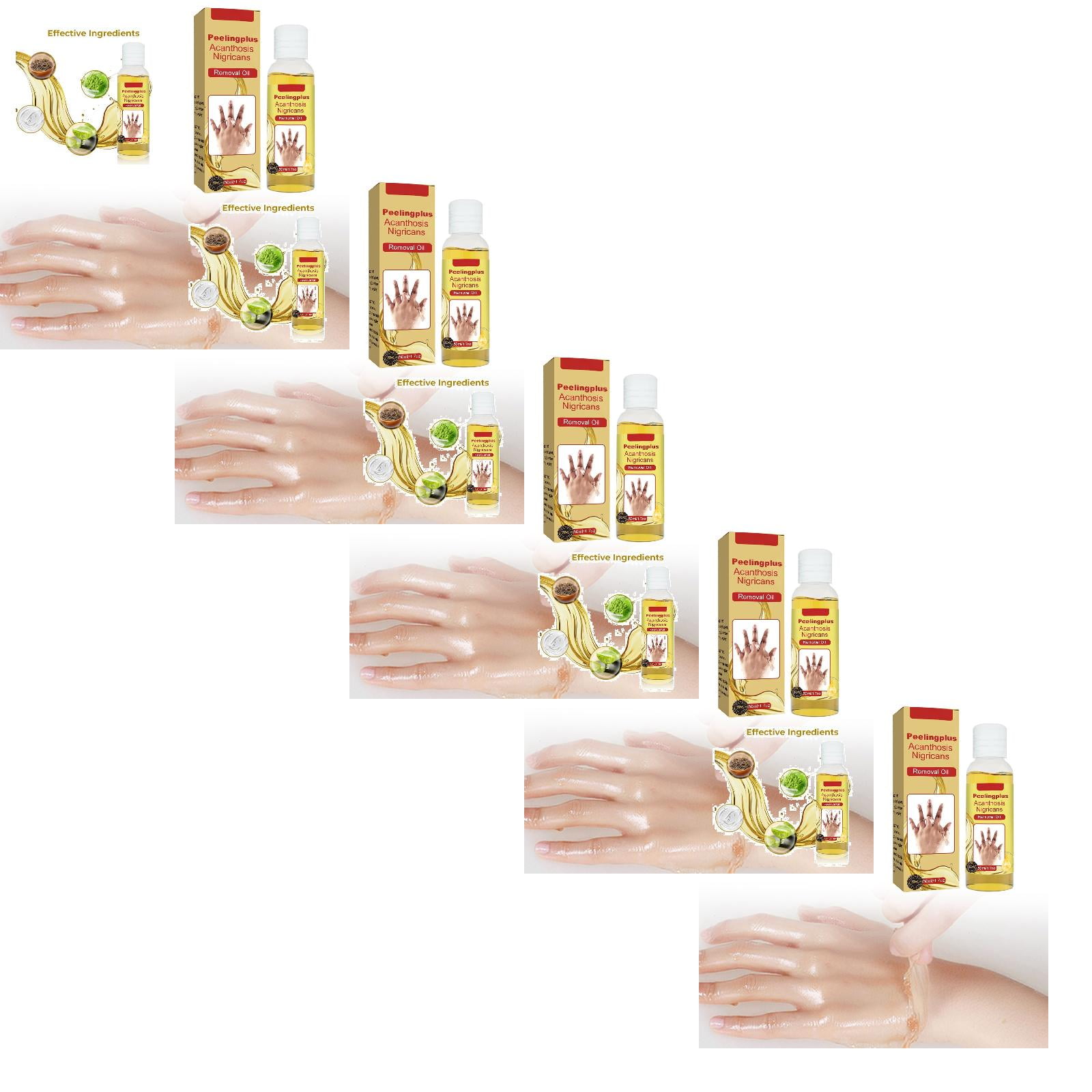 Keratosis Exfoliating Oil Underarms Knees Elbows Joints Brighten Skin ...