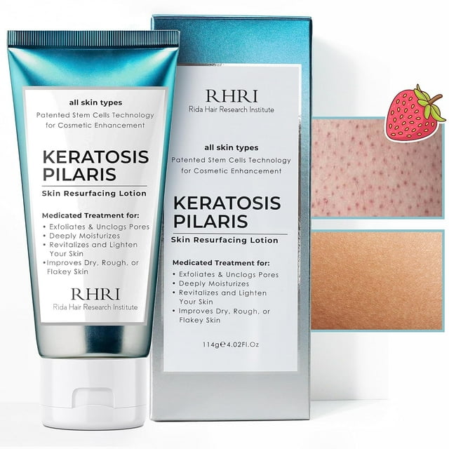 Keratosis Pilaris Treatment | DMF15 Keratosis Pilaris KP Gentle Exfoliation For Strawberry Legs ...