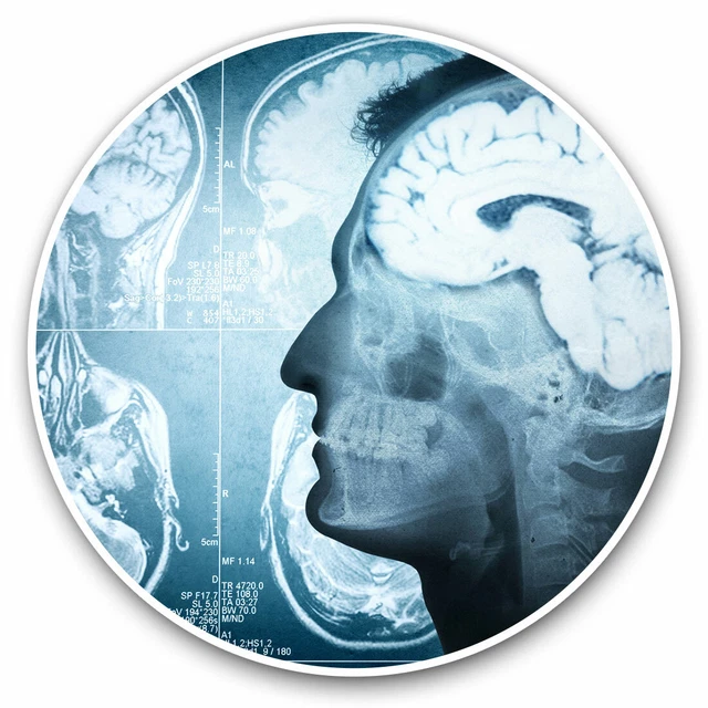 Kira Sticker With Brain X-Ray Medical Scan Doctor Cool Gift Decorative ...