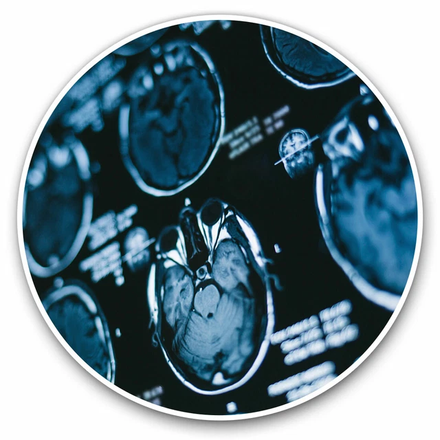 Kira Sticker With Mri Brain Scan X-Ray Images Cool Gift Decorative ...