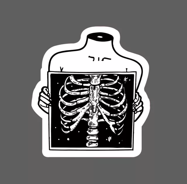 Kira Sticker With X-Ray Chest Bones Waterproof Decorative Laptop, Phone ...