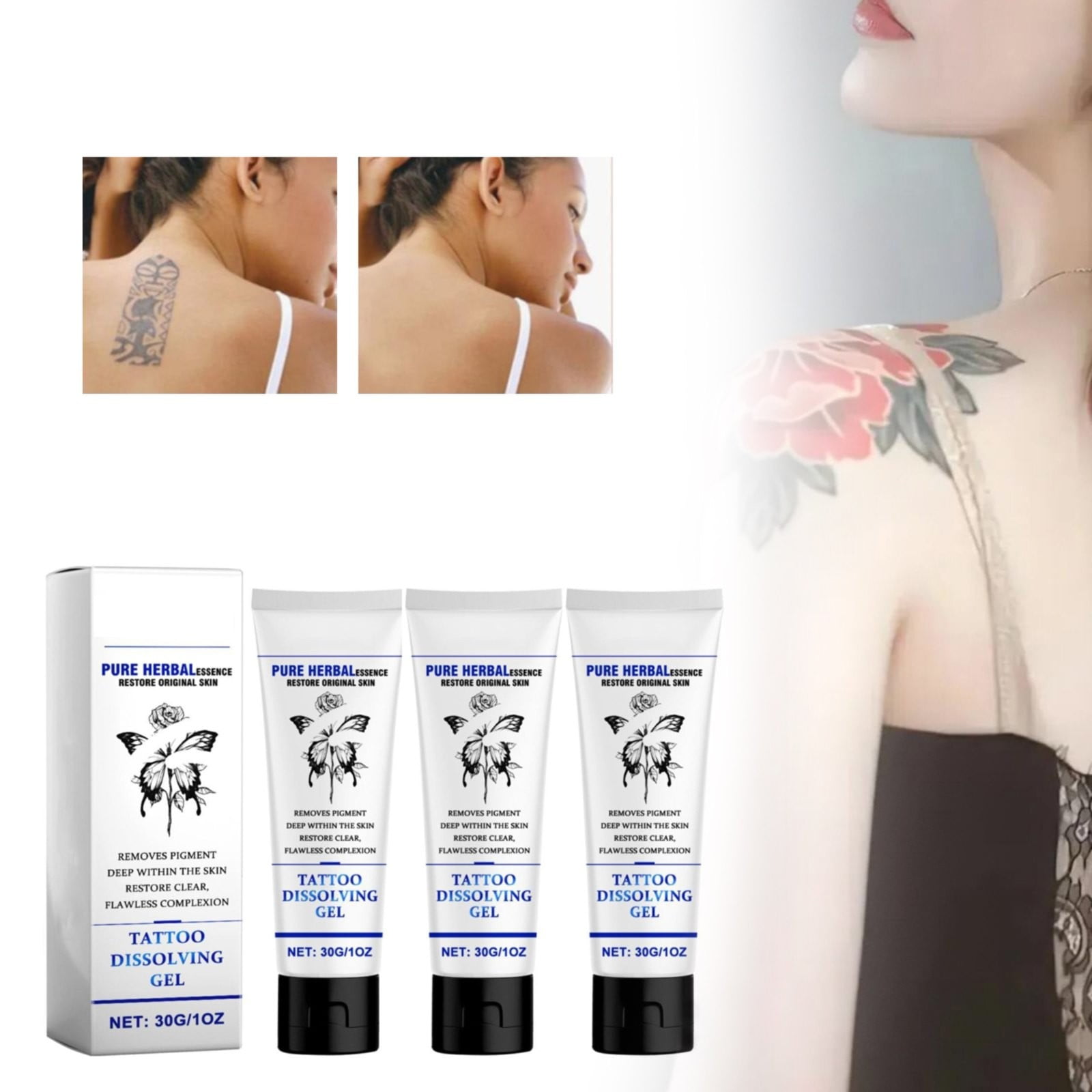 Kitecy Personal Skin Care Big Price Cuts! Removal Fast and Effective ... Kitecy Personal Skin Care Big Price Cuts! Removal Fast and Effective ...