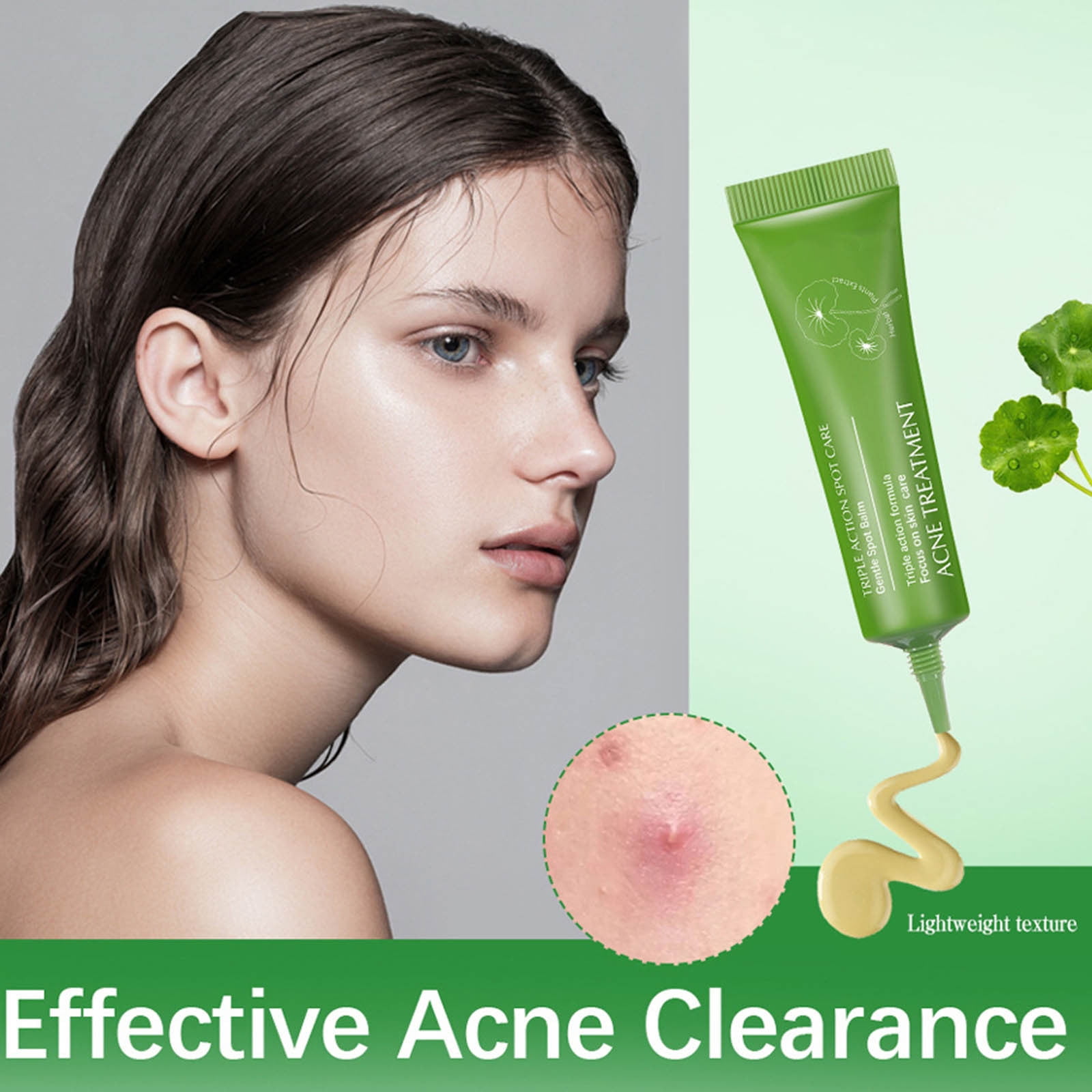 Kiuxbfg 15G Herbal for Pimple and Blackhead Removal With Scar Fading ...