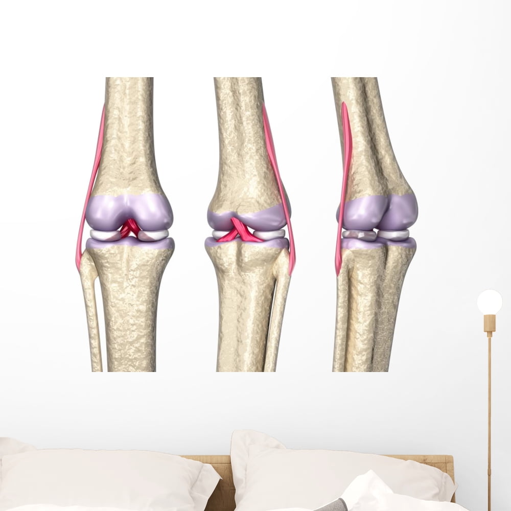 Knee Joint Anatomy 3D Wall Mural Decal Sticker, Wallmonkeys Peel ...