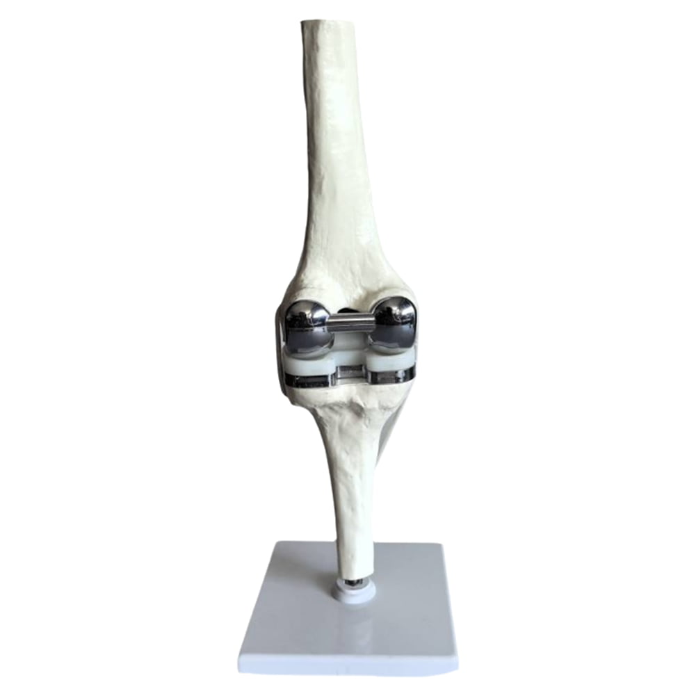 Knee Joint Model Simulation Replacement Surgery Meniscus Ligament ...