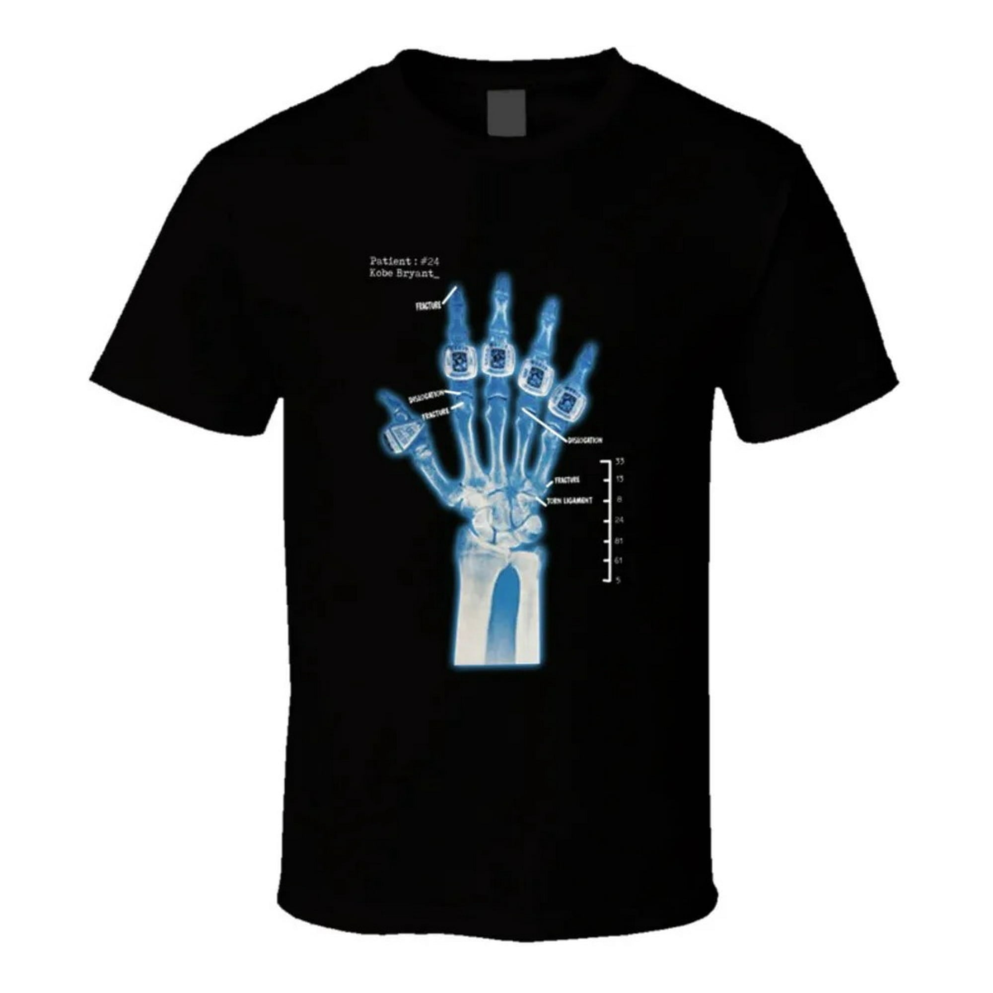 Kobe-Bryant-Hand-X-Ray-Rings-Cha - Walmart.com