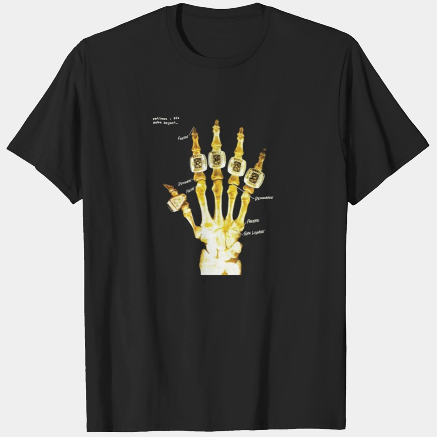 Kobe X-Ray Shirt T-Shirts Tshirt, S, NAVY - Walmart.com