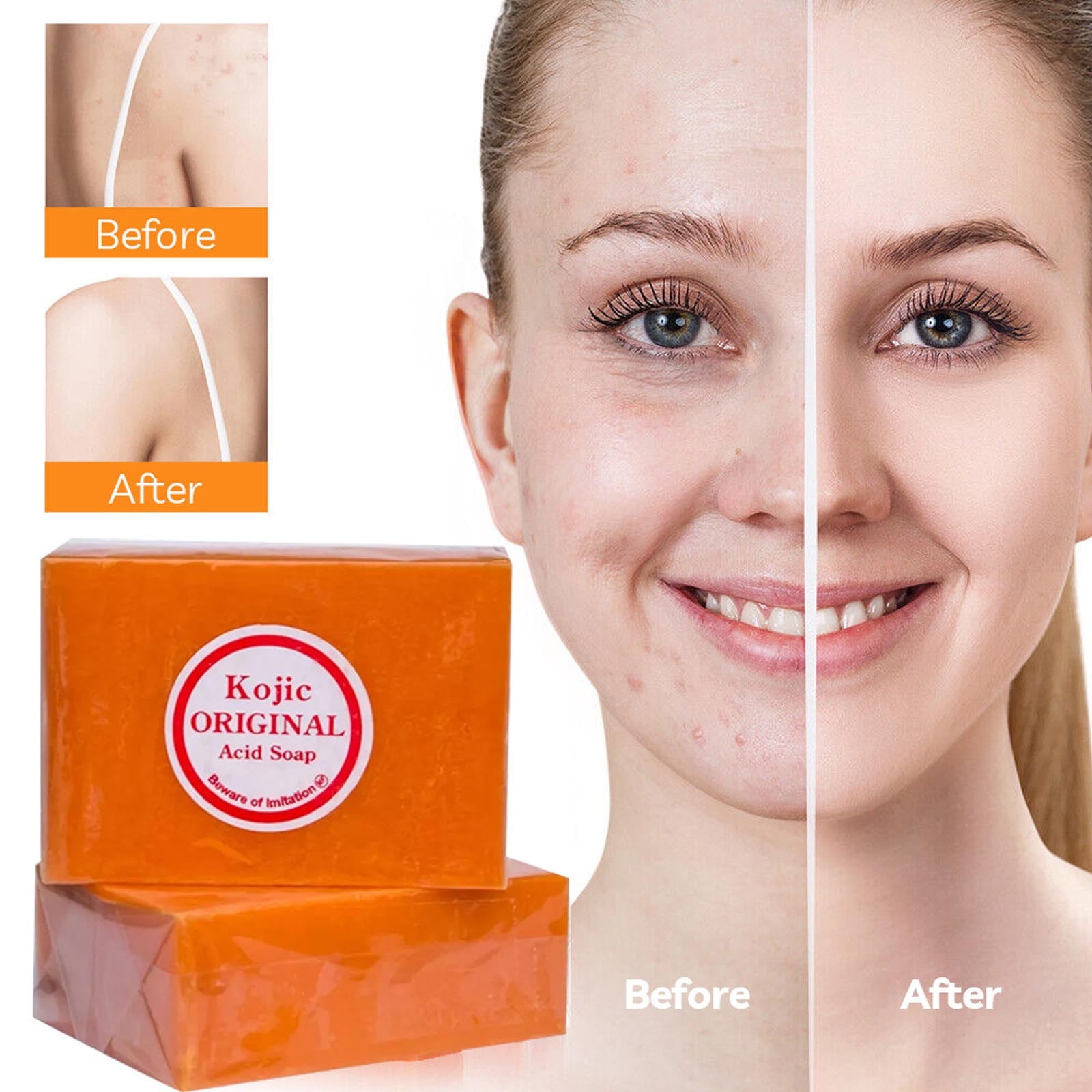Kojic Acid Soap Skin Lightening For Dark Spots, Lemon Turmeric Soap ...