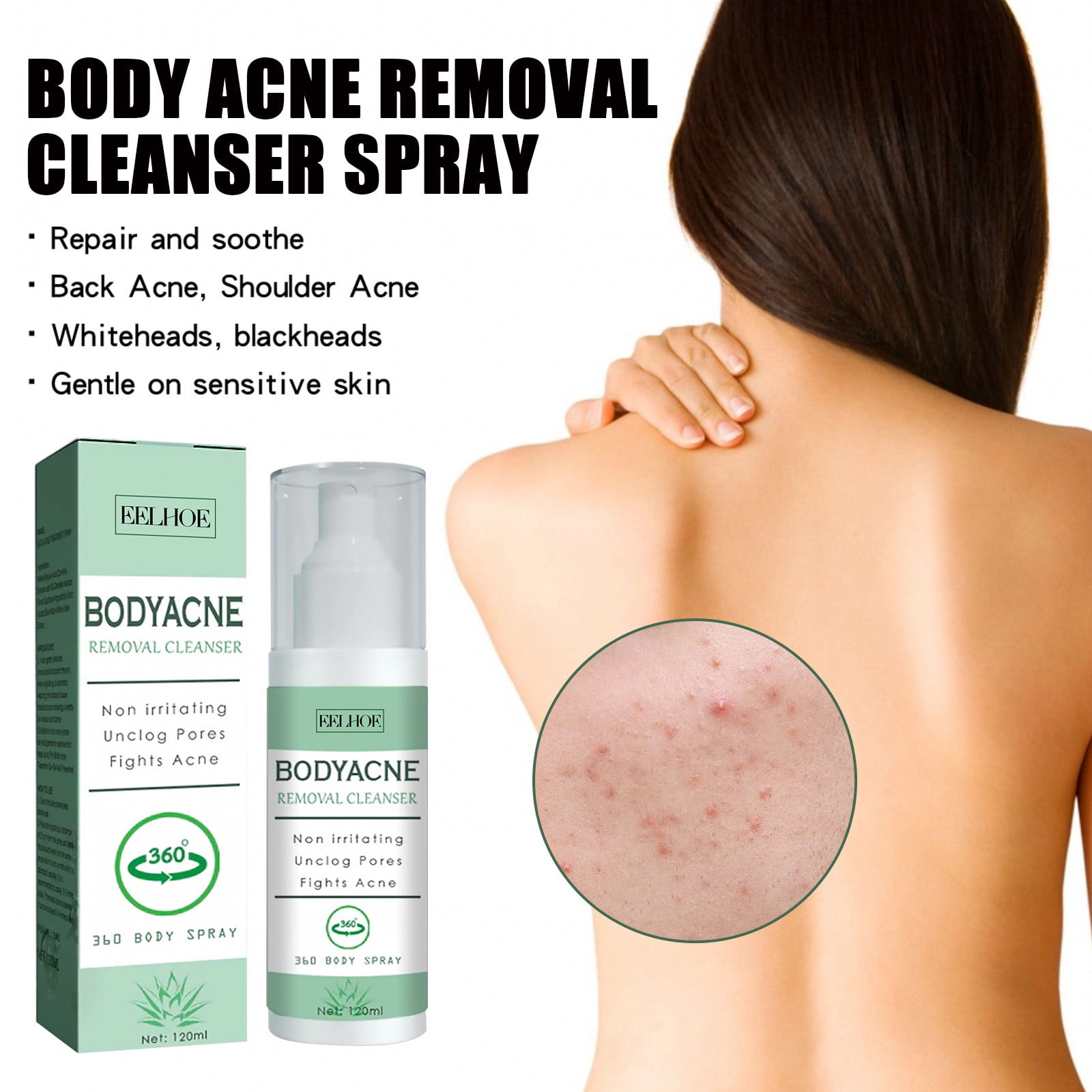 Kokovifyves Beauty Products Sale Body Acne Removing Cleaning Spray for ... Kokovifyves Beauty Products Sale Body Acne Removing Cleaning Spray for ...