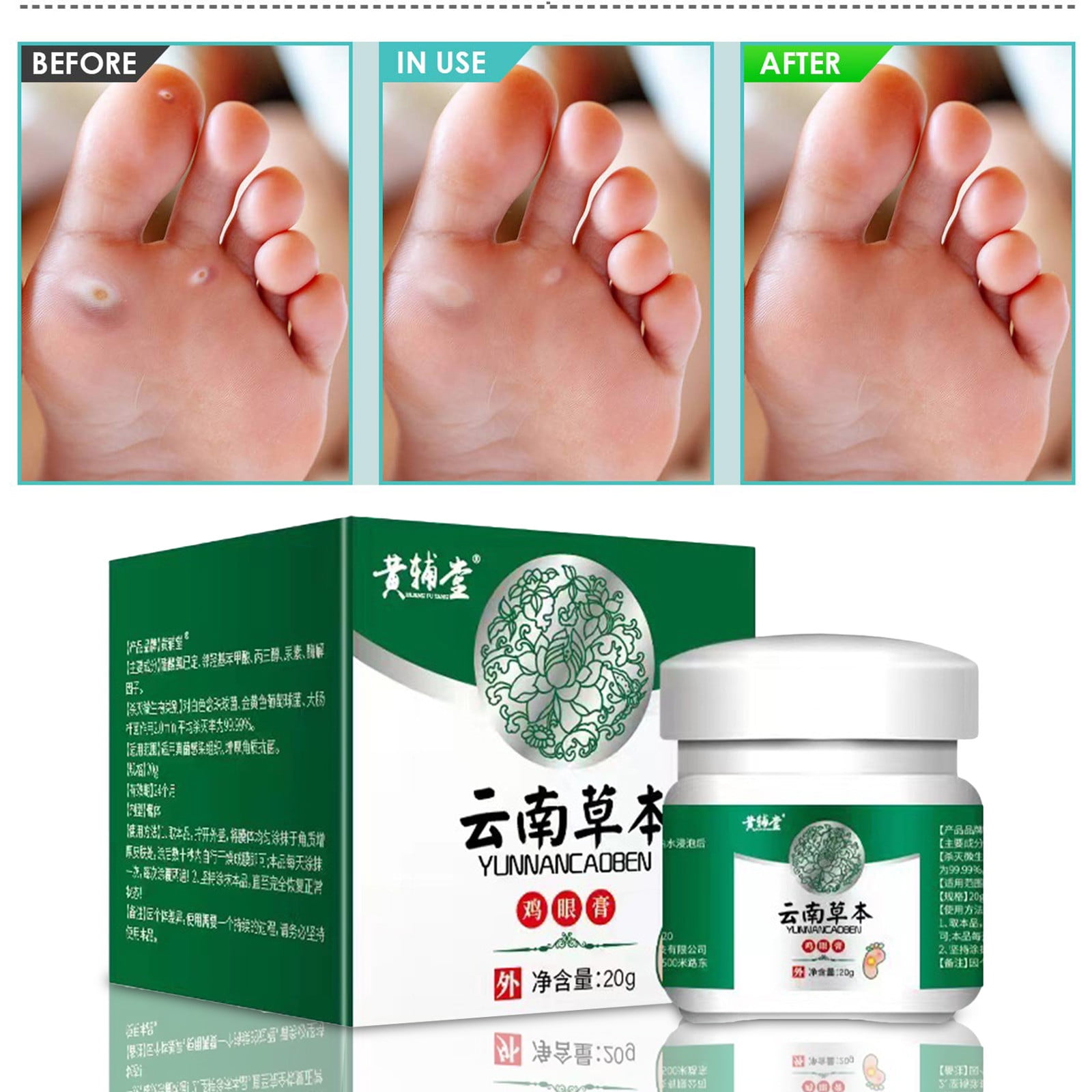 Kokovifyves Beauty Products Sale Corn Plaster Super Strong Made From ... Kokovifyves Beauty Products Sale Corn Plaster Super Strong Made From ...