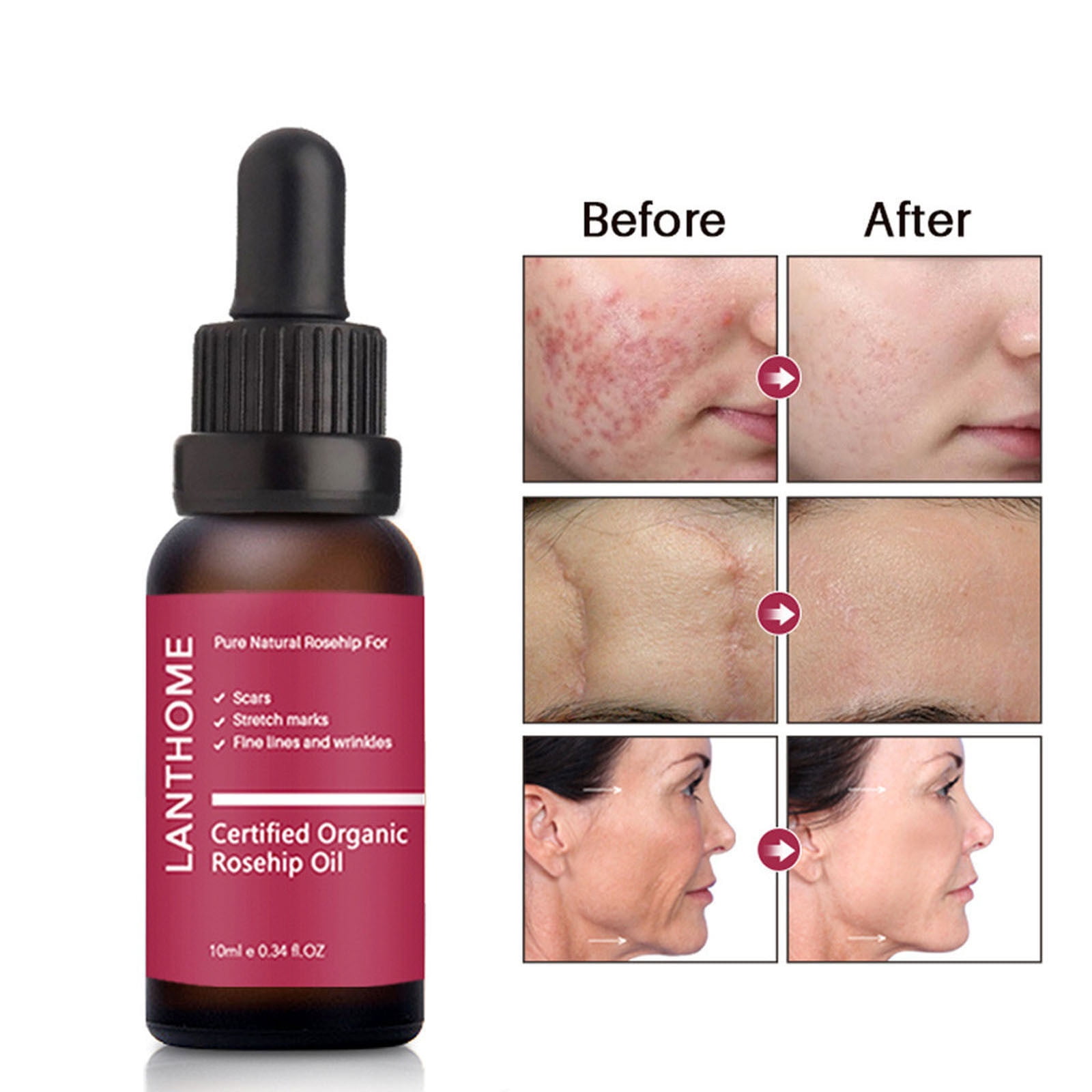 Kokovifyves Beauty Products Sale Rose Extract Essential Oil Anti ... Kokovifyves Beauty Products Sale Rose Extract Essential Oil Anti ...