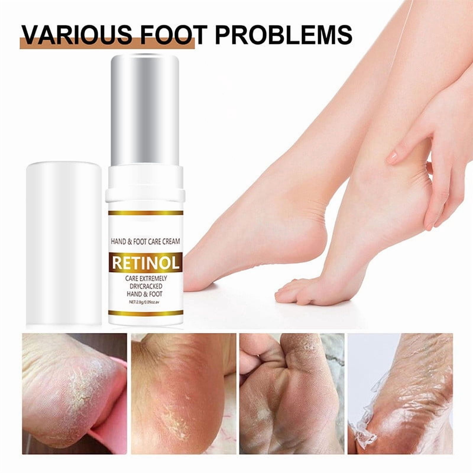 Kokovifyves Retinol Heel Dry and Cracked Foot Cream Moisturizing Hand ...