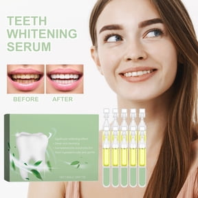 Natural White, Tooth Whitening System, 5 Minute, Includes Duplex Tray ...