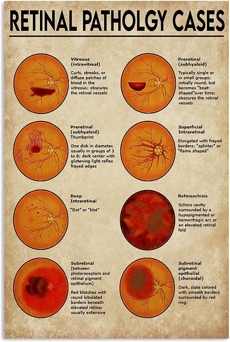 Krav- Maga Basics Metal Sign Vintage Martial Arts Club Decor Maga Art ...