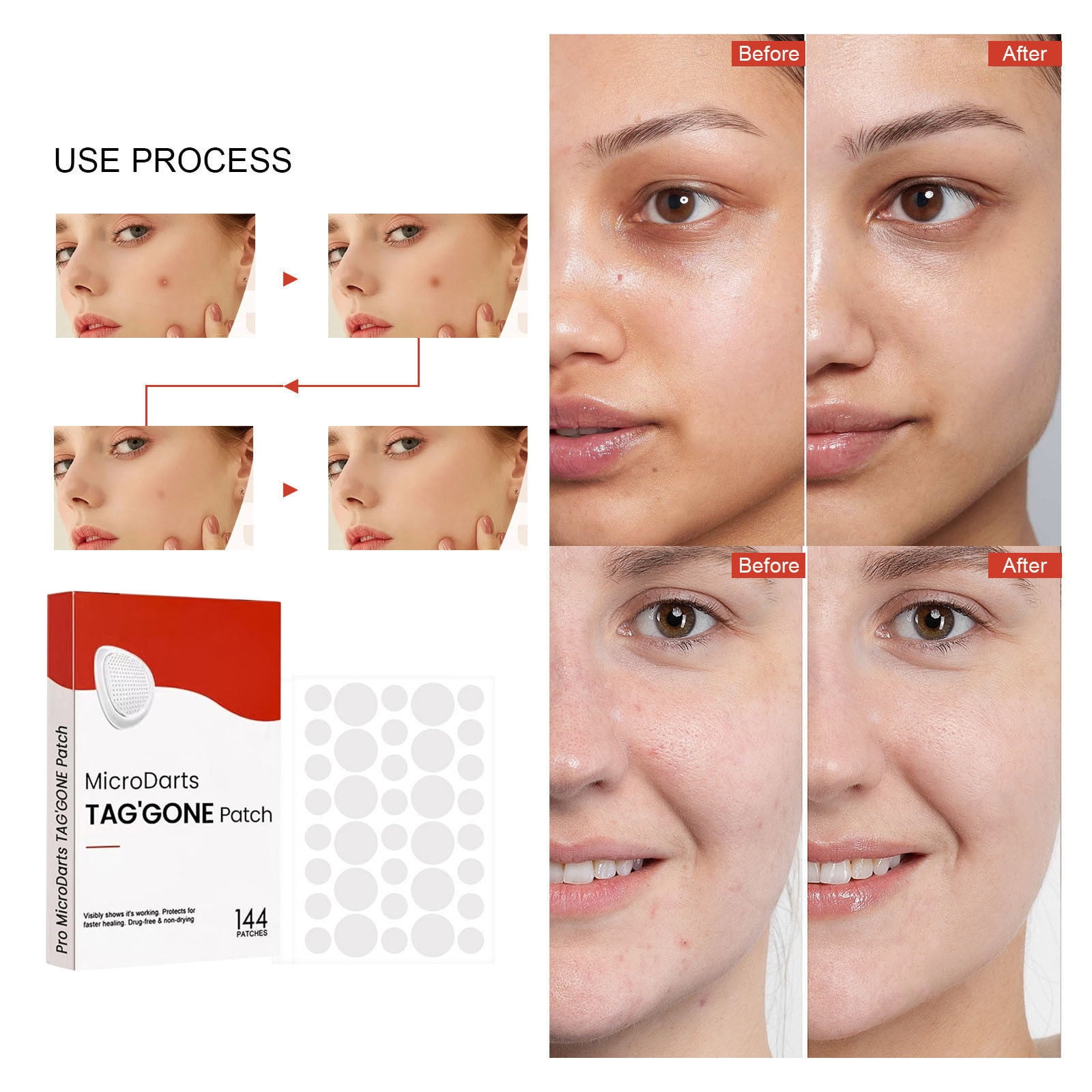 Kubozn Pro Microdarts Nano Patch, Natural Skin and Face Care Patch ...