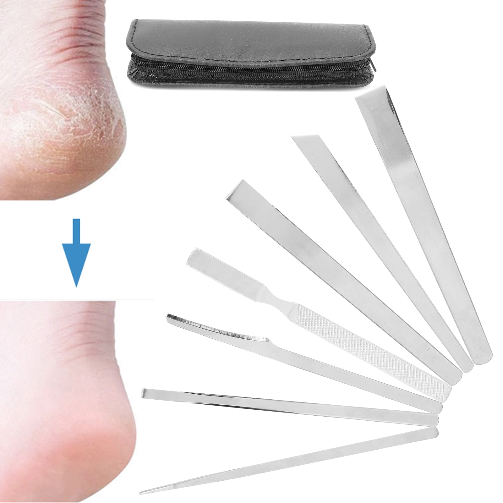 LAFGUR Pedicure Knife Set Household Ingrown Toe Nail Dead Skin Calluses ...