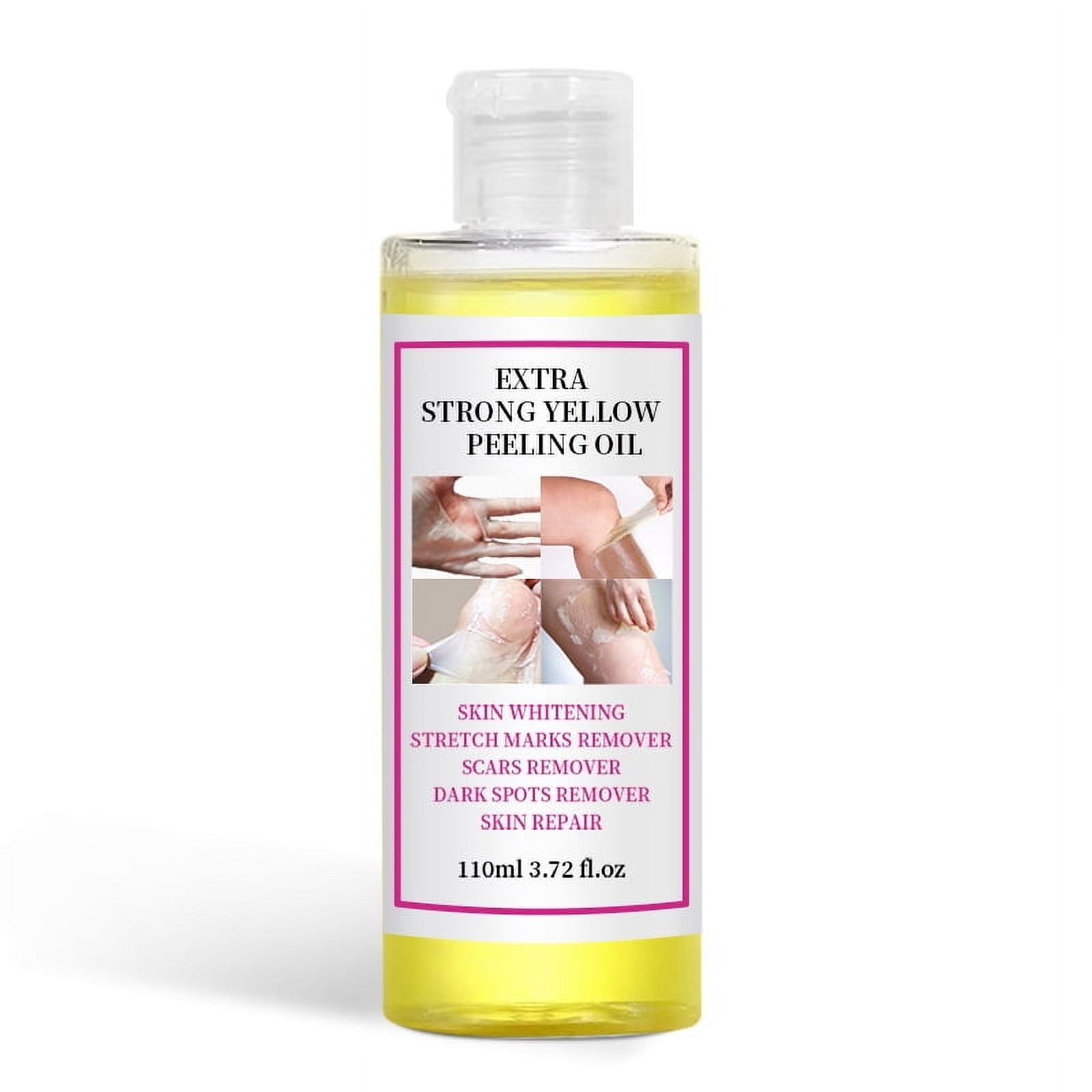 LAOLAO Skin Care Yellow Peeling Oil For Dark Skin Strong Peel Oil Extra ...