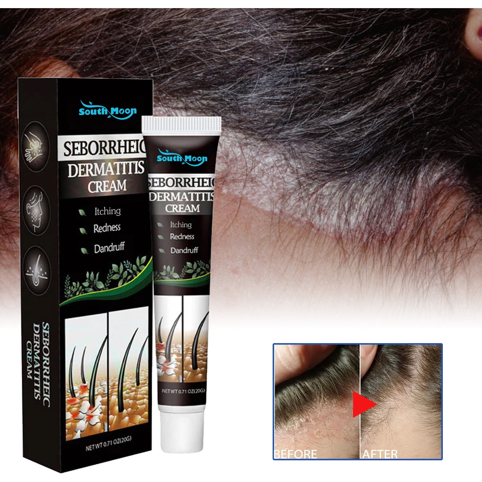 Lehoziheq Scalp Care Cream Topical Solution For Irritated Scalp Improves The Appearance Of