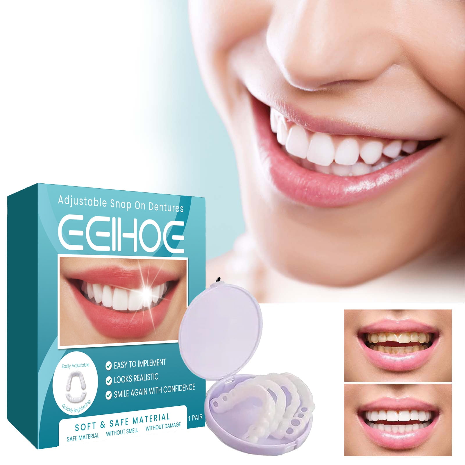 LELINKER 1pair Denture Teeth Temporary Fake Teeth, Snap On Top and ...