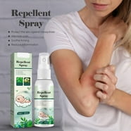 Chigg Away 4 fl oz Lotion for Itchy Skin and Bug Bite Relief - Walmart.com