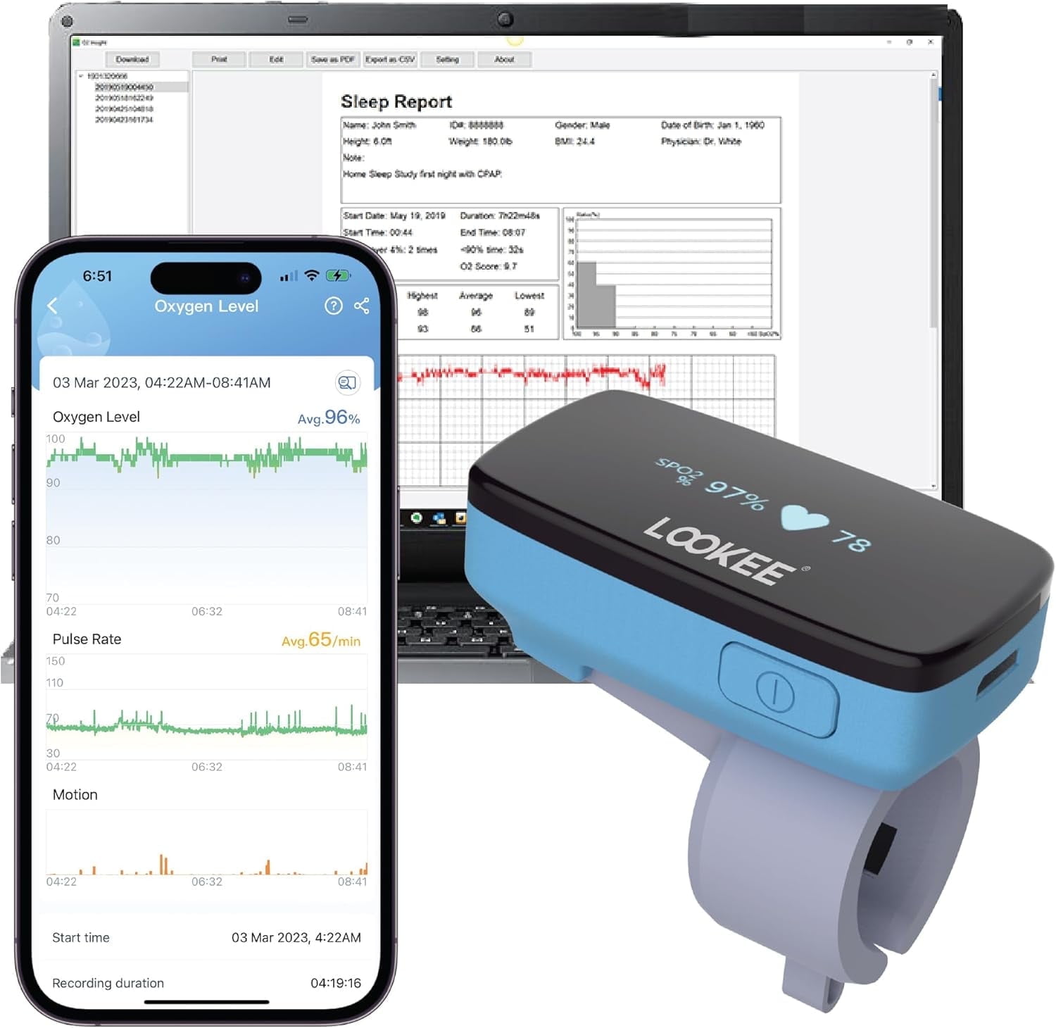 LOOKEE Ring-Pro Oxygen Finger Monitor with Vibration Reminder | Wearable Continuous Finger Pulse ...