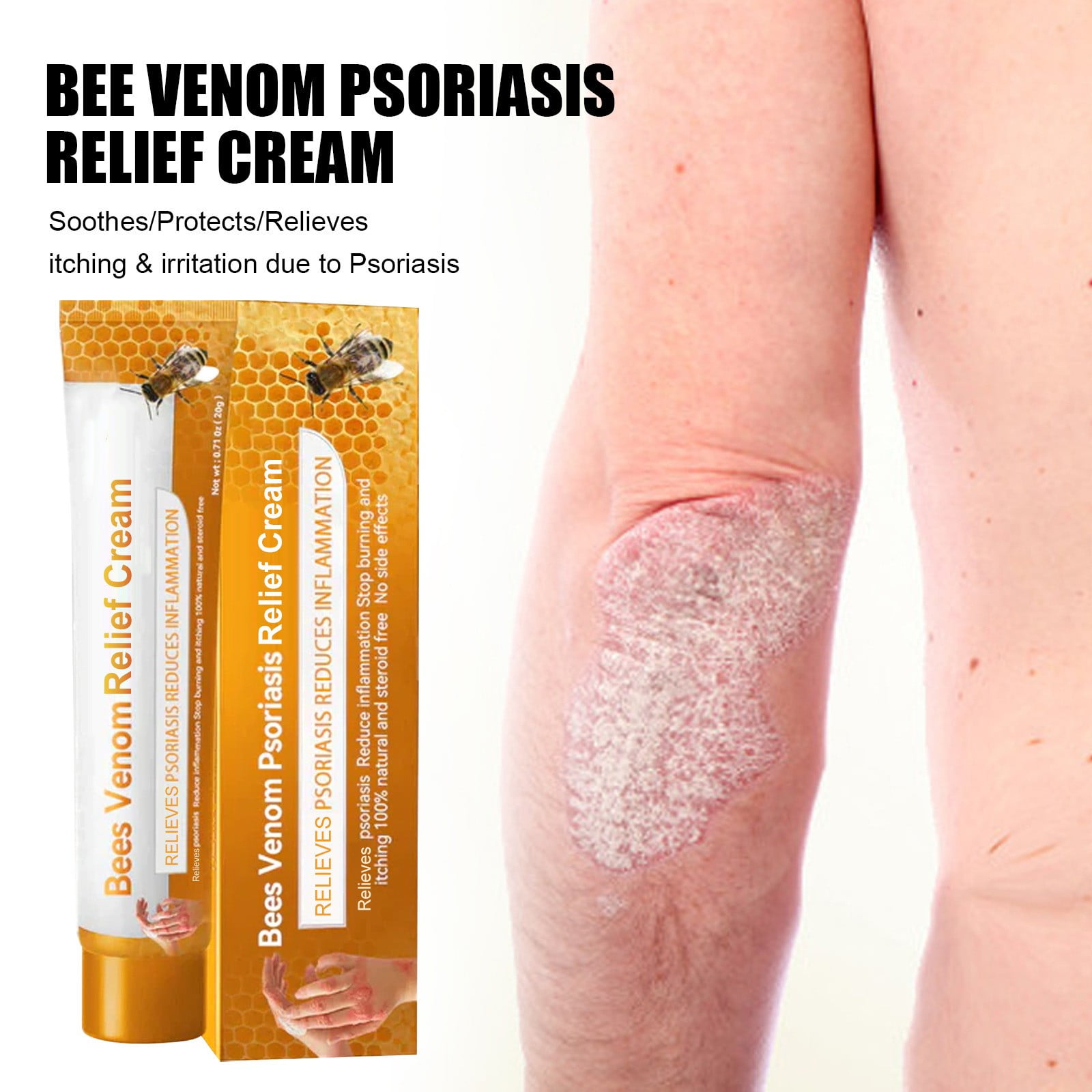 LPSSTORE 20g Body Skin Care Ointment 20g Noxious Anti Itch Paste Body ...