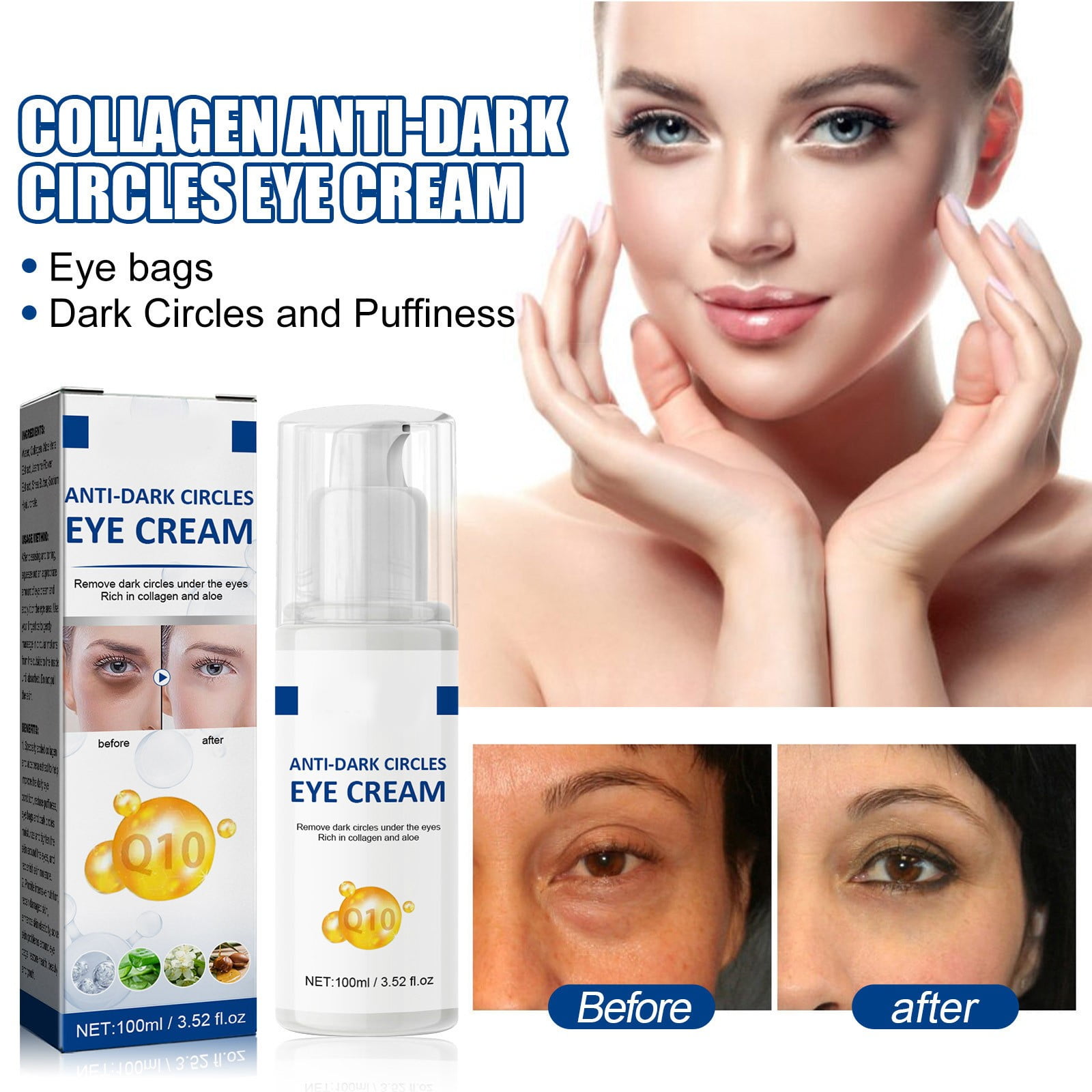 LPSSTORE Jasmine Ointment for Dark Circles Jasmine Ointment Plus Eye ...