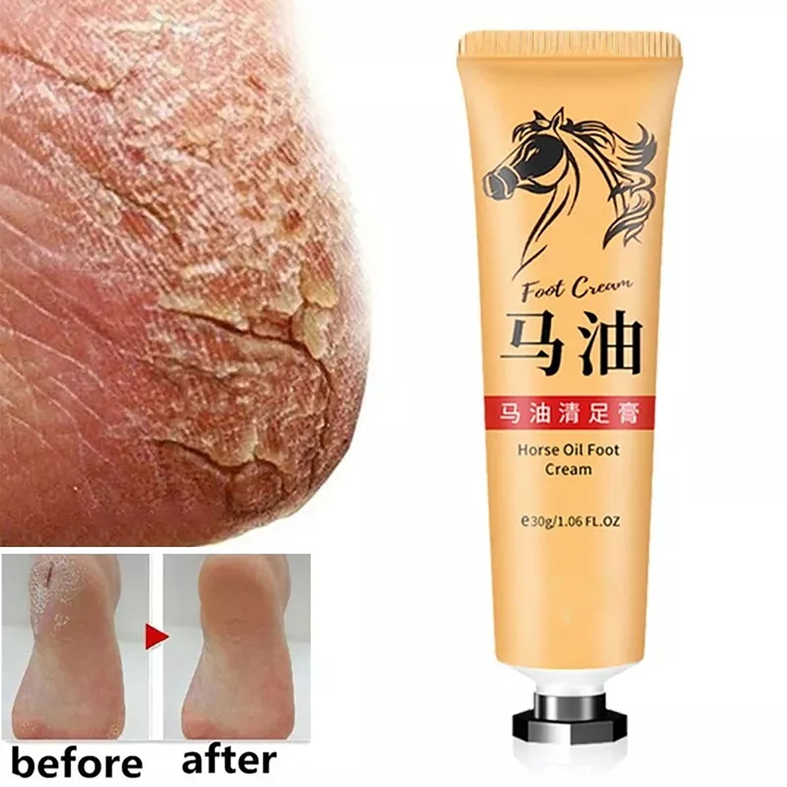 LPSSTORE Moisturizing Skin Hand & Foot Frostbite Prevention 30ML ...
