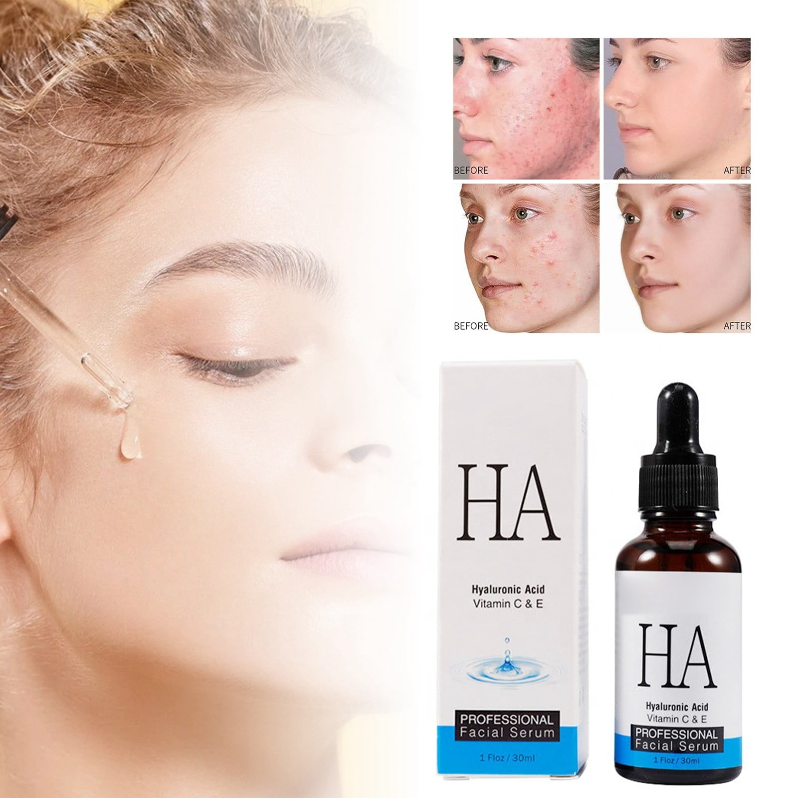 LPSSTORE Powerful Aging Formula Brightens and Evens Skin Tone 30ml HA - Walmart.com