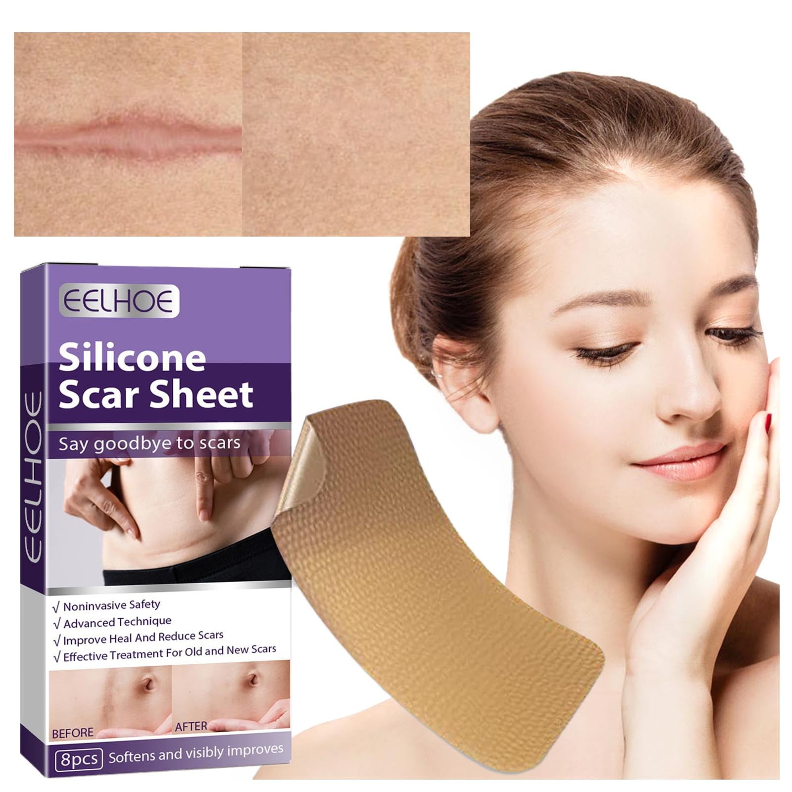 LPSSTORE Silicone Fade Stretch Marks Cesarean Scar Hyperplasia Scar ...