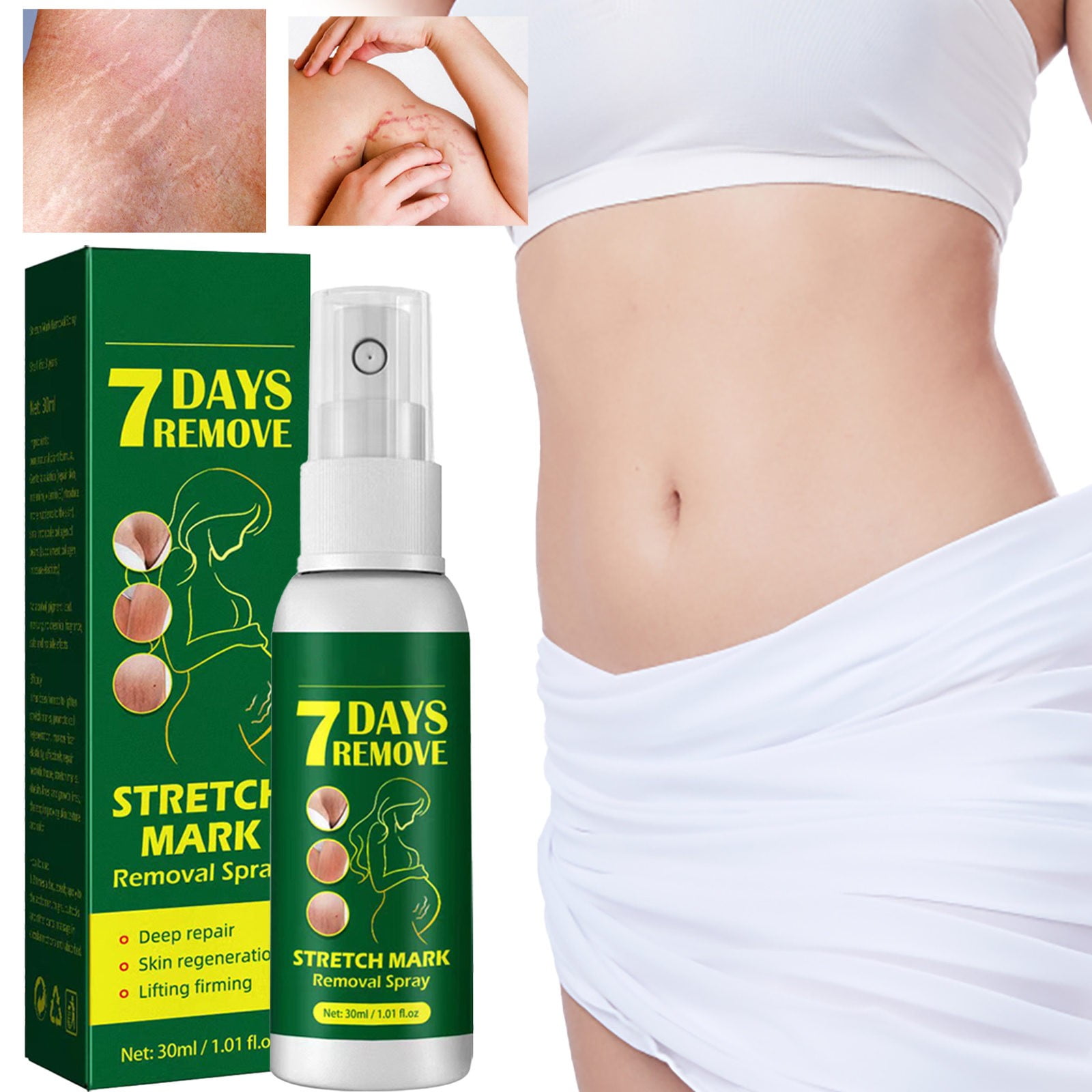 LPSSTORE Stretch Marks Removal Spray Stretch Marks Belly Stretch Marks ...