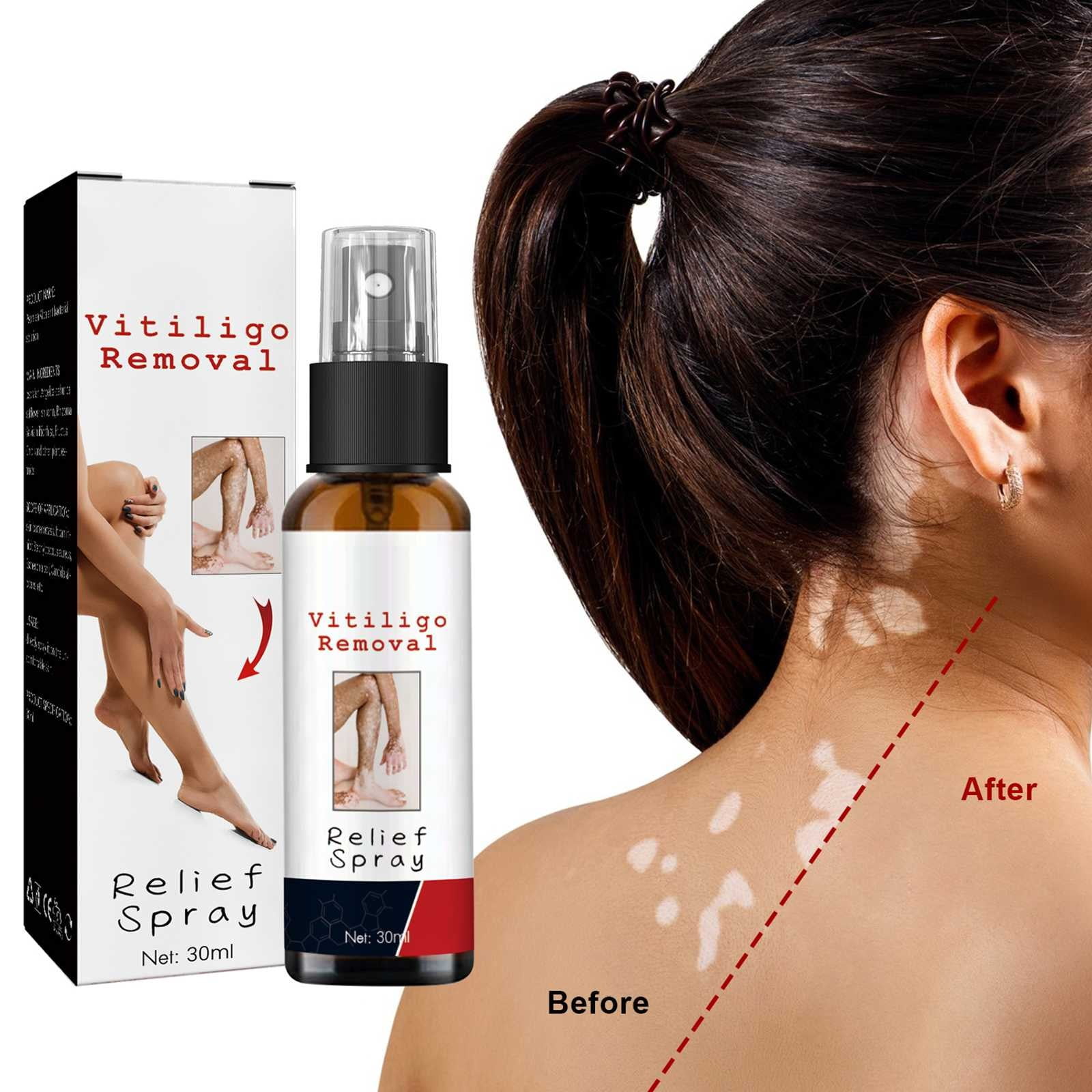 LPSSTORE White Spray to Lighten White Spots Flecks Sweat Spots Beautify ...
