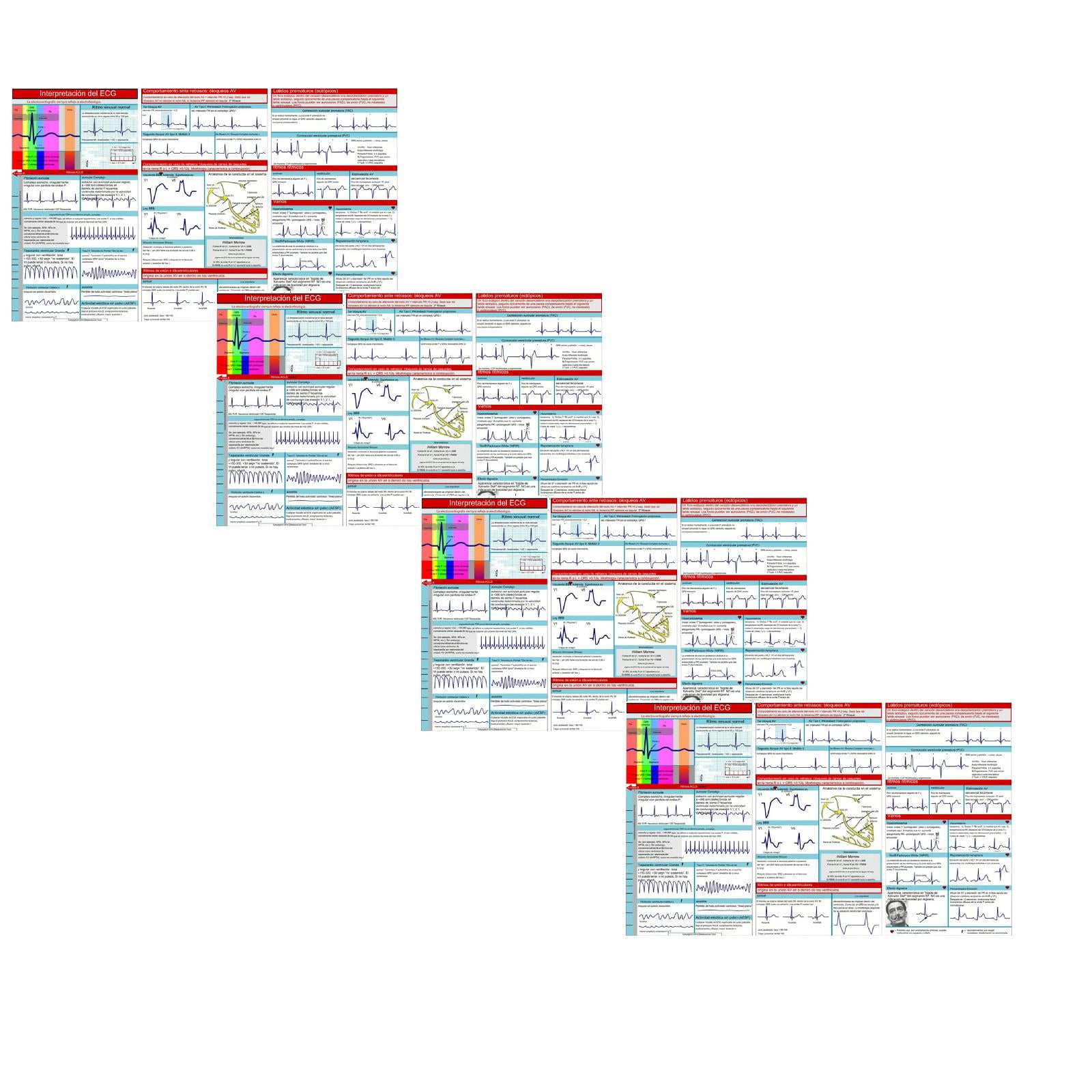 LQXZWJY EKG Rhythm Interpretation - Compact & Portable Reference Card – Rapid Interpretation ...