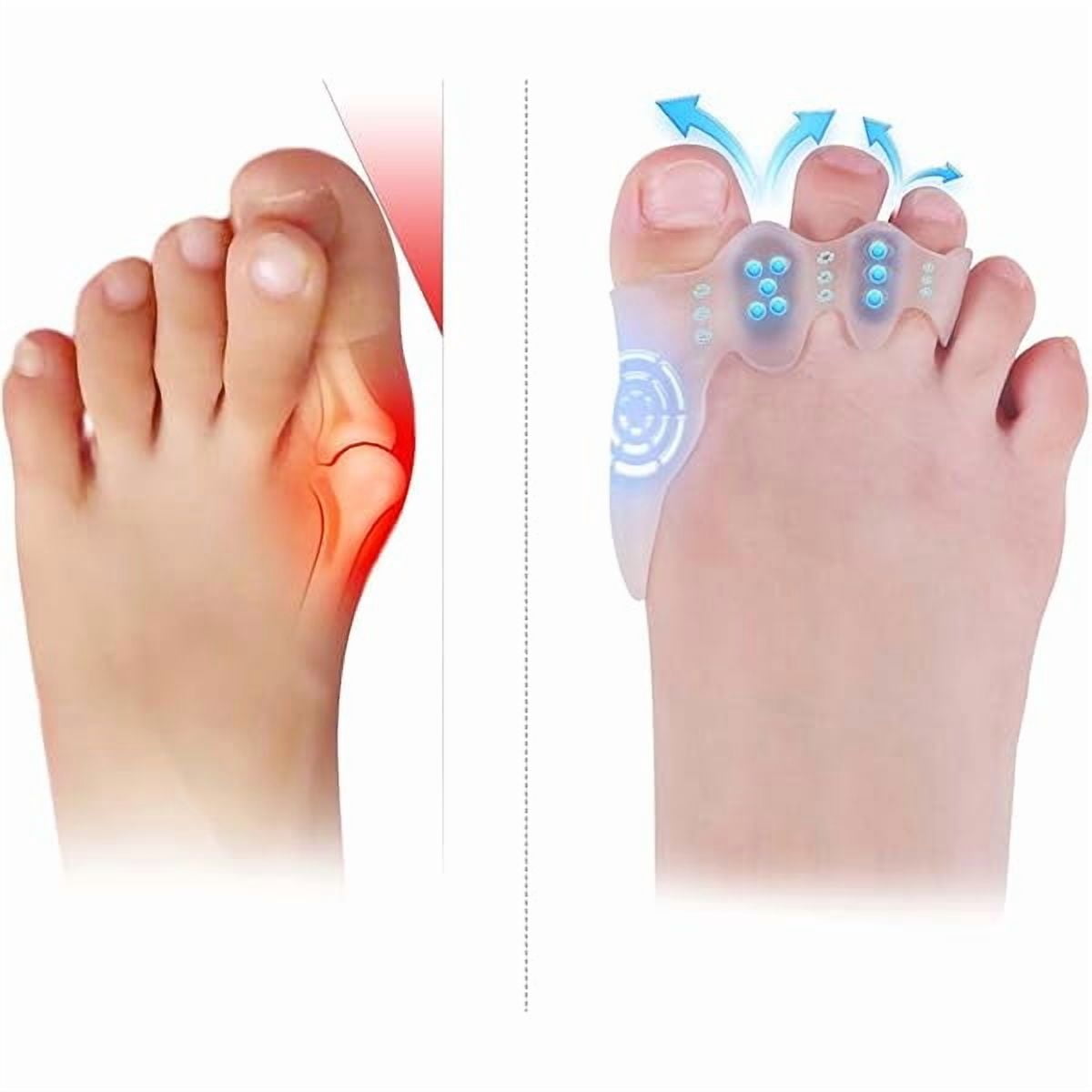 LYHToe Spacers & Bunion Corrector for Kids | Toe Separators,Corn Callus ...