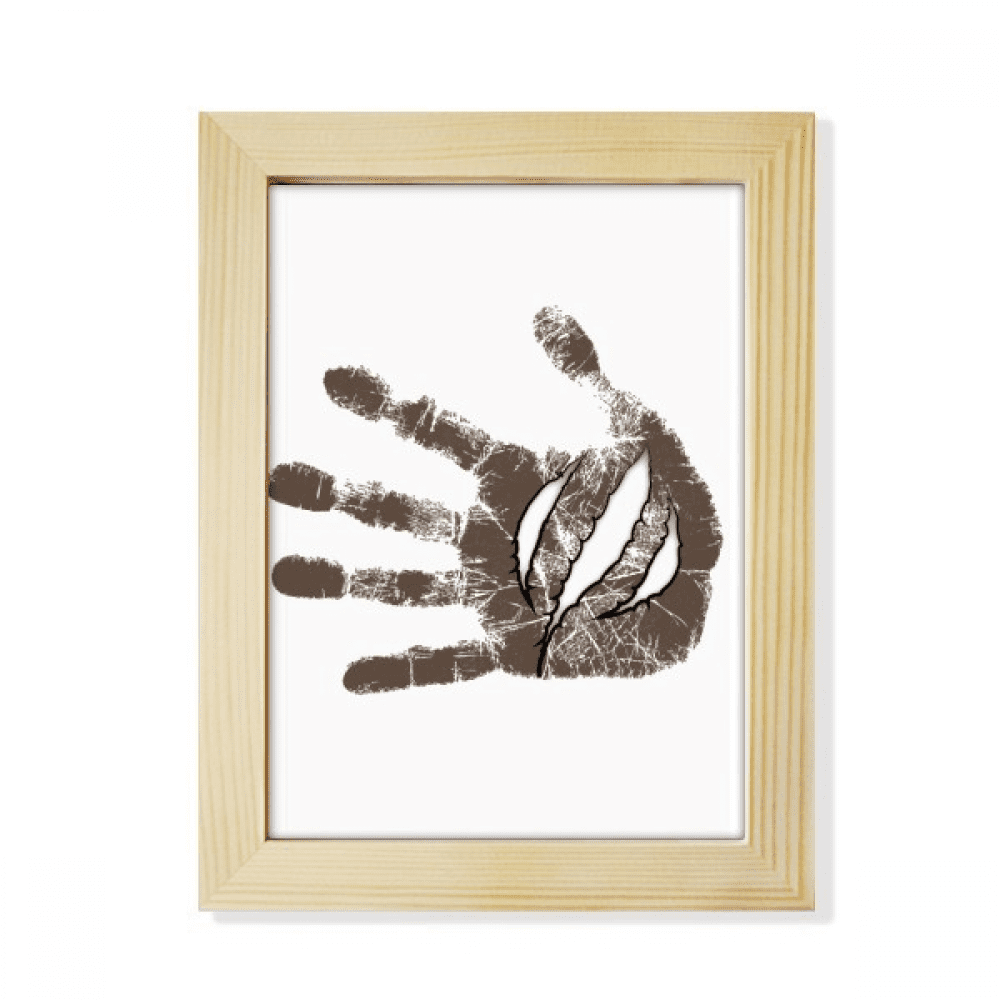 Laceration Marks Handprint Wound Desktop Adorn Photo Frame Display Art ...