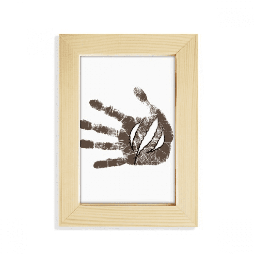 Laceration Marks Handprint Wound Desktop Display Photo Frame Picture ...