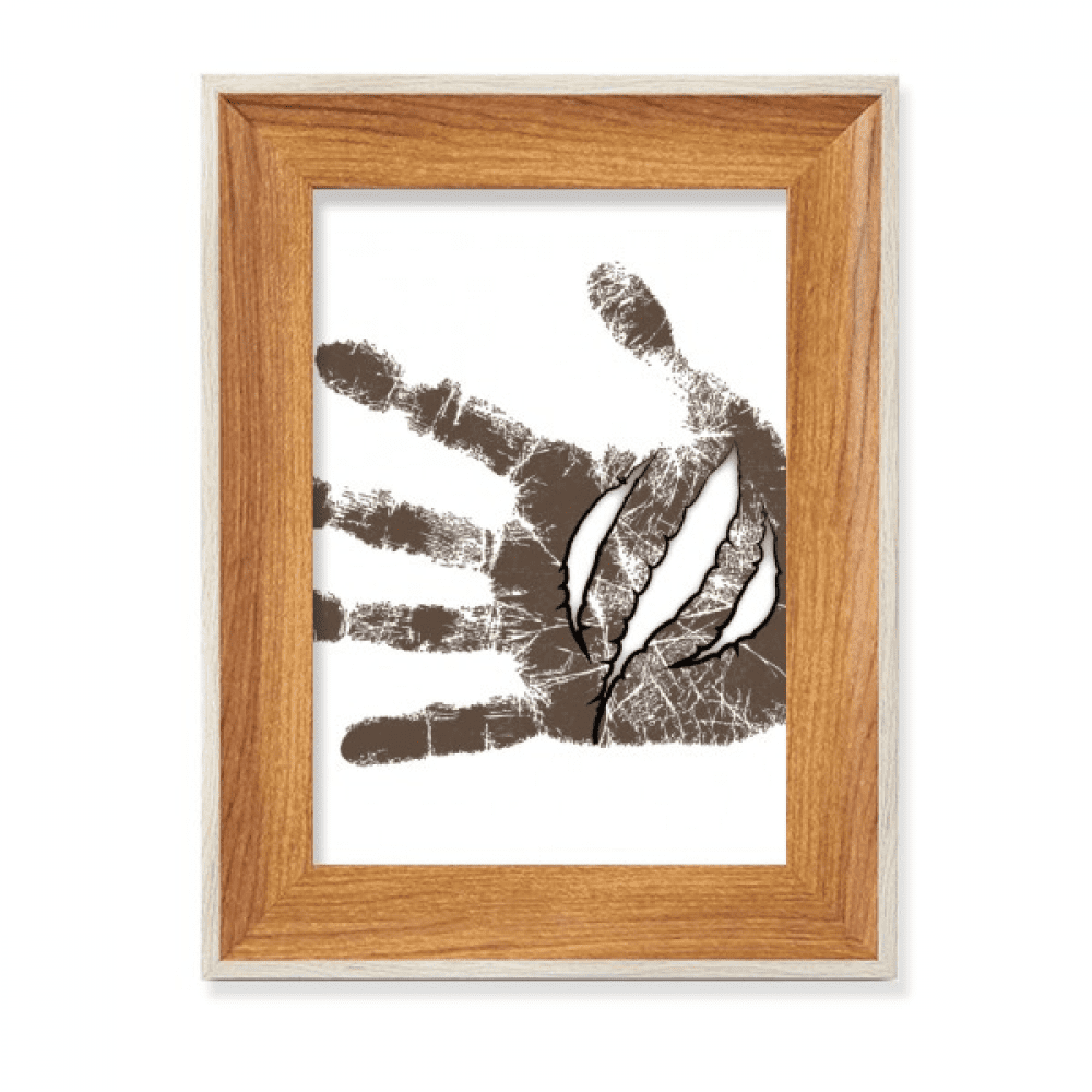 Laceration Marks Handprint Wound Desktop Wooden Photo Frame Display ...