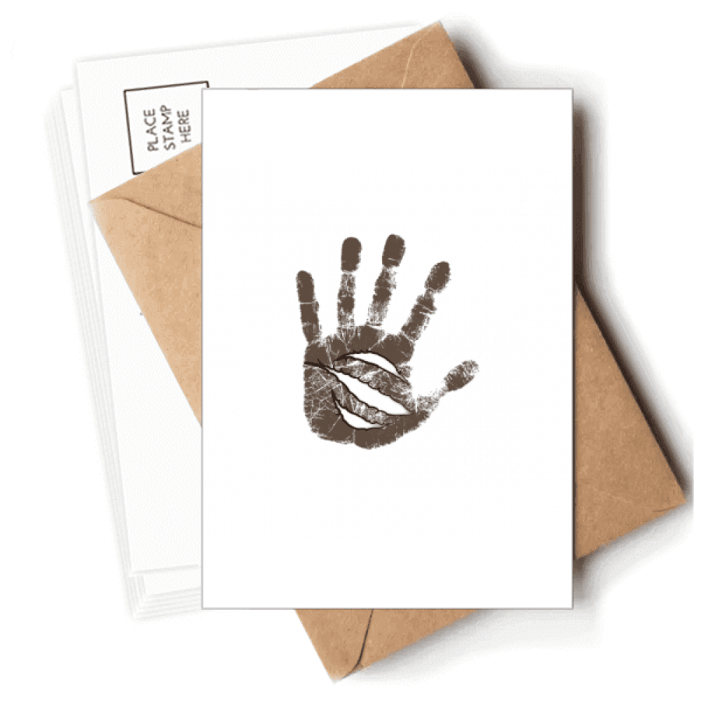 Laceration Marks Handprint Wound Postcards Envelopes Blank Note Cards ...