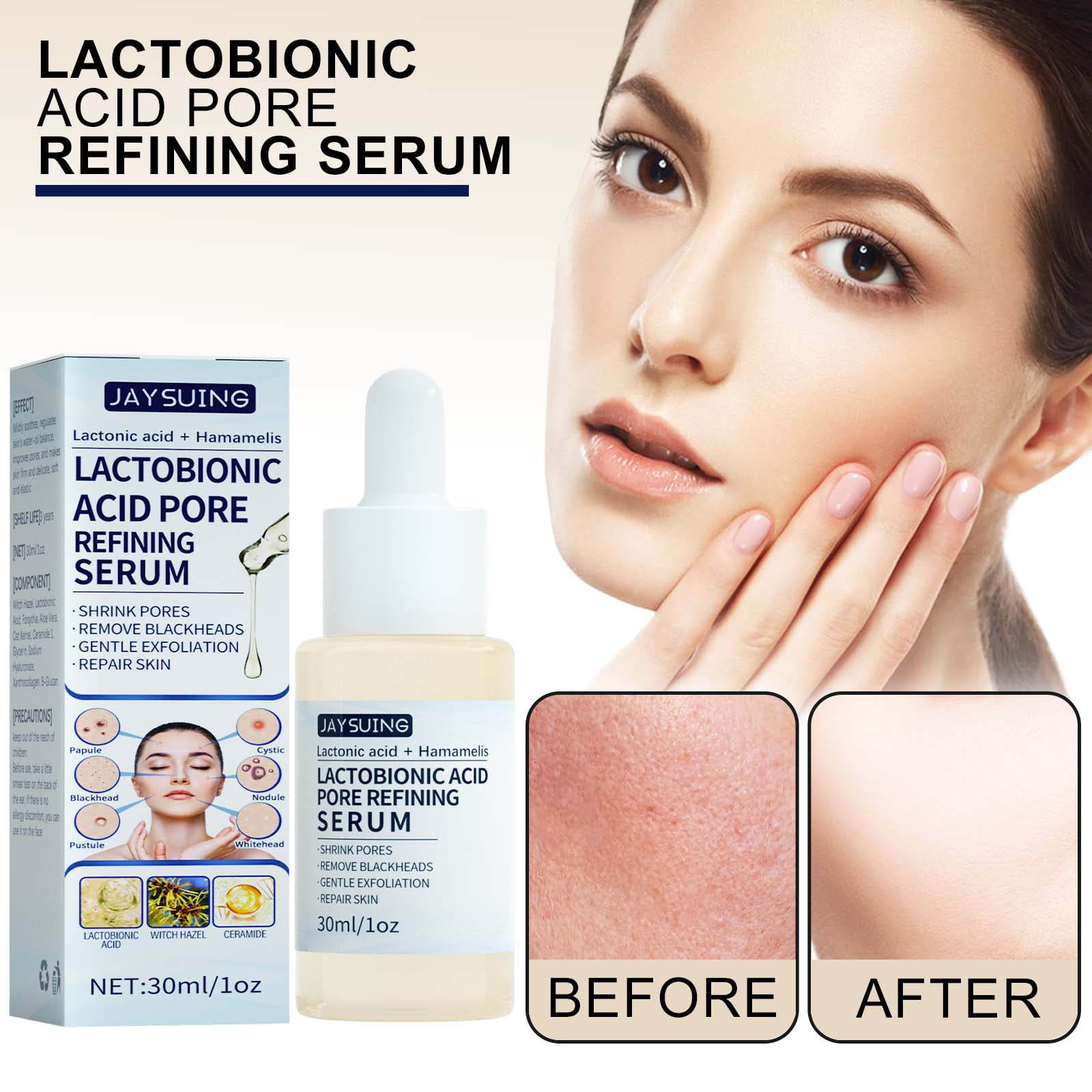 Lactobionic acid essence, exfoliation, blackhead reduction, pore ...