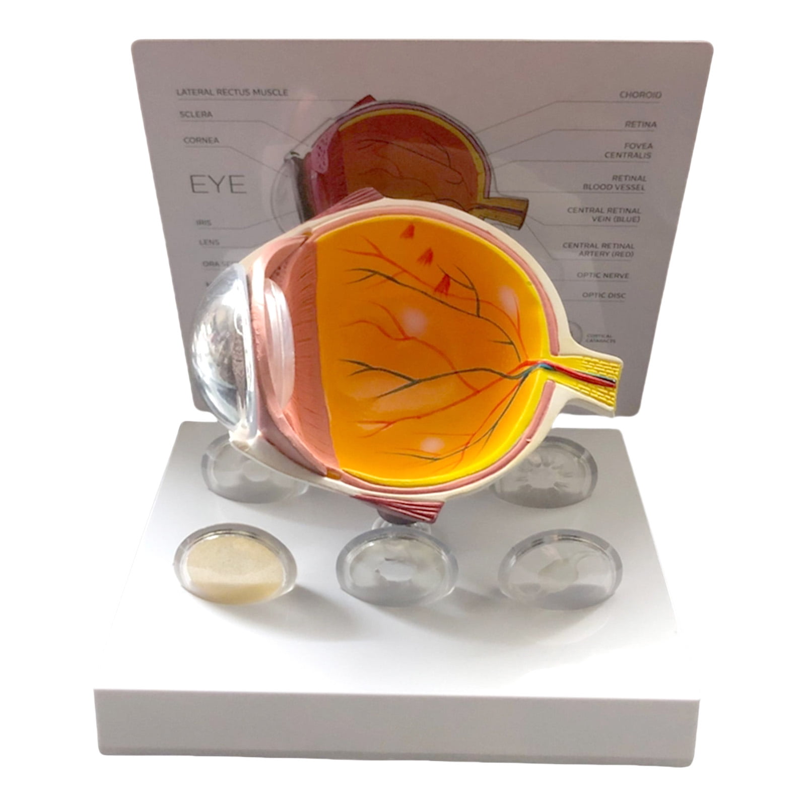 Ladaidra Brown fhgksm Human Anatomical Eye Model Pathological Eyeball ...