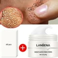 Lanbena Blackhead Remover Cream Plant Pore Strips For Nose Acne